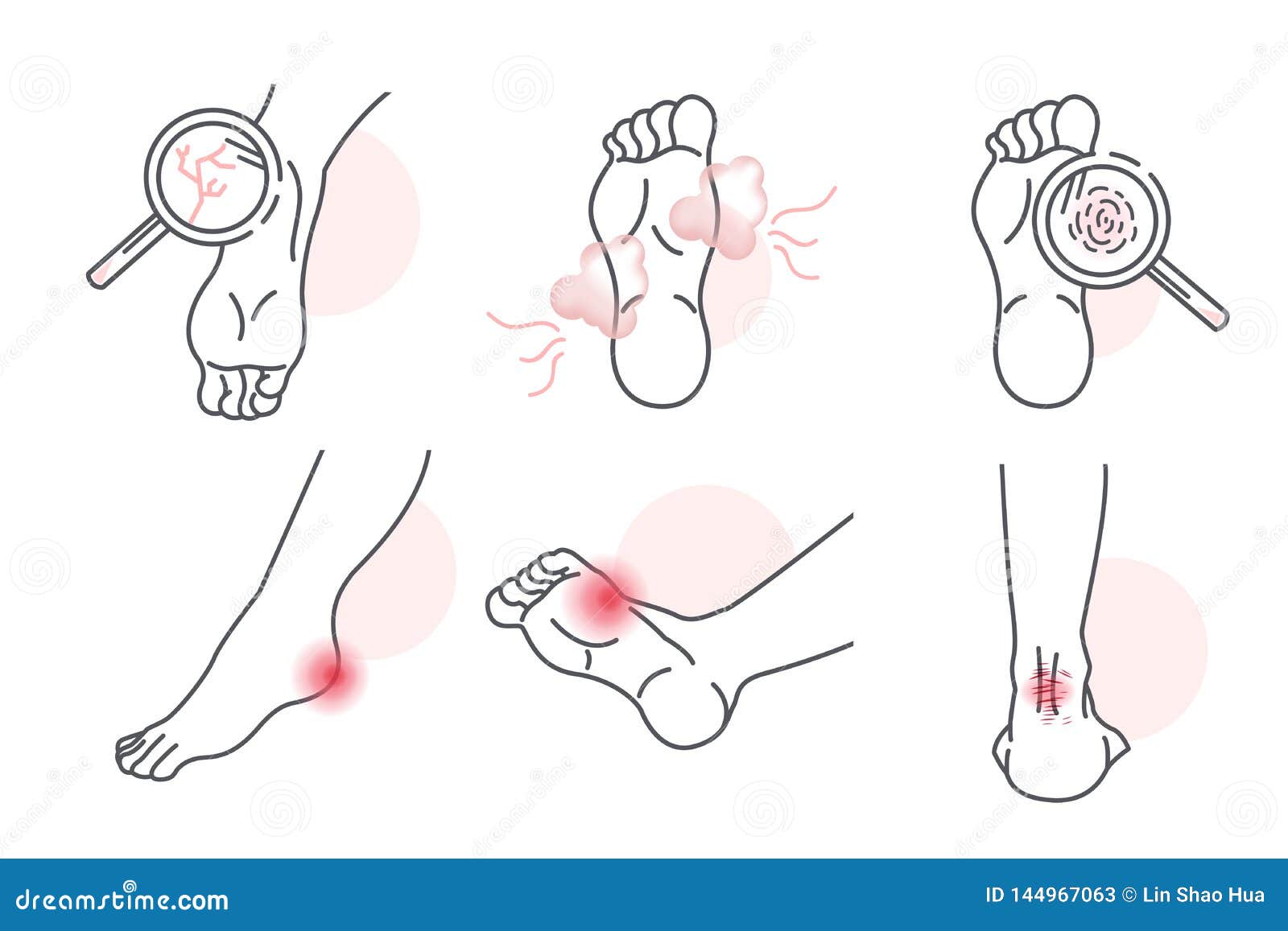 Skin Stink Hygiene Trouble, Body Reek Symbol Collection. Stench Skin ...