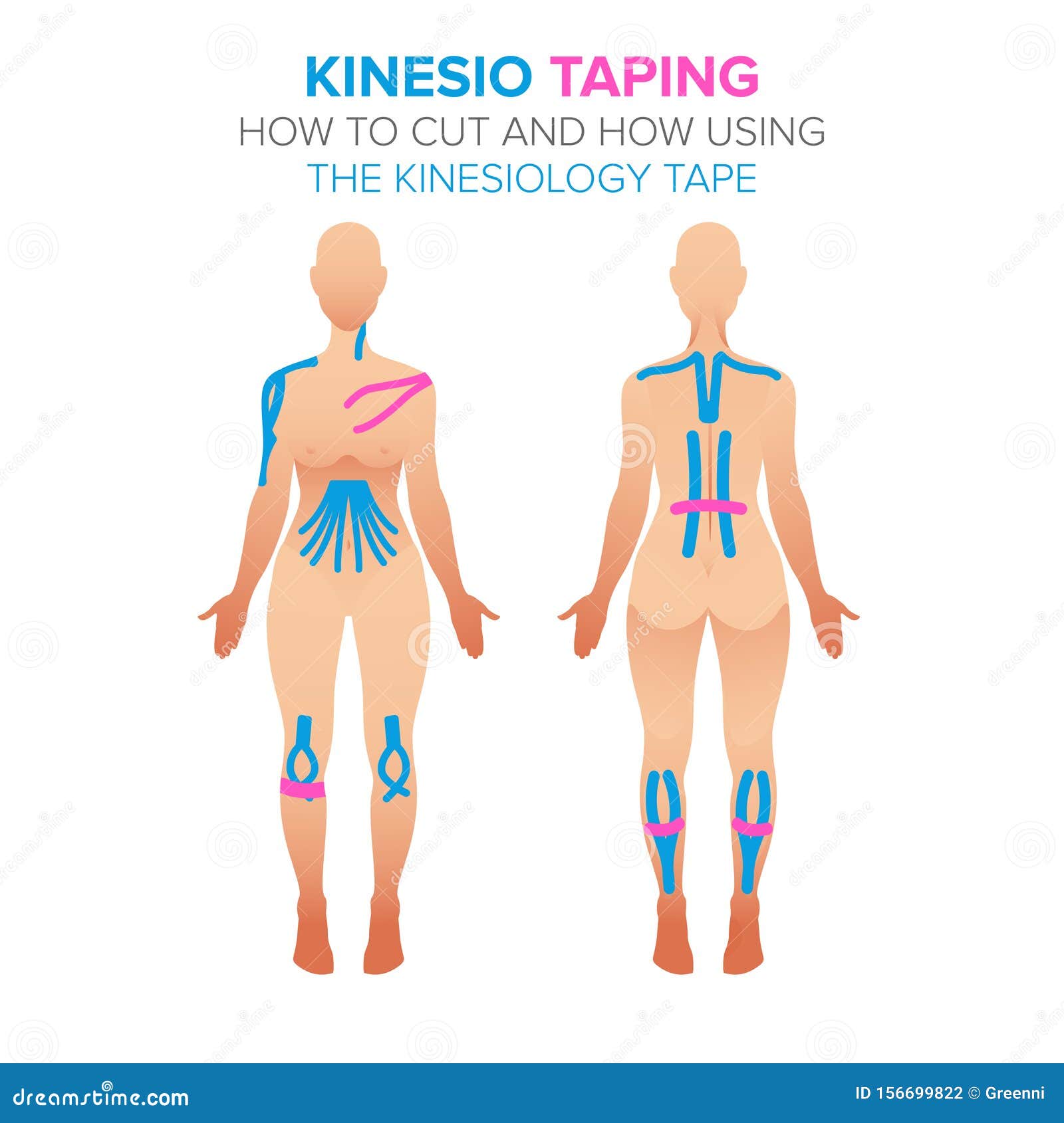 Kinesio Taping Vector Illustrations | CartoonDealer.com #150320836 Kinesio Taping Vector Illustrations | CartoonDealer.com #150320836