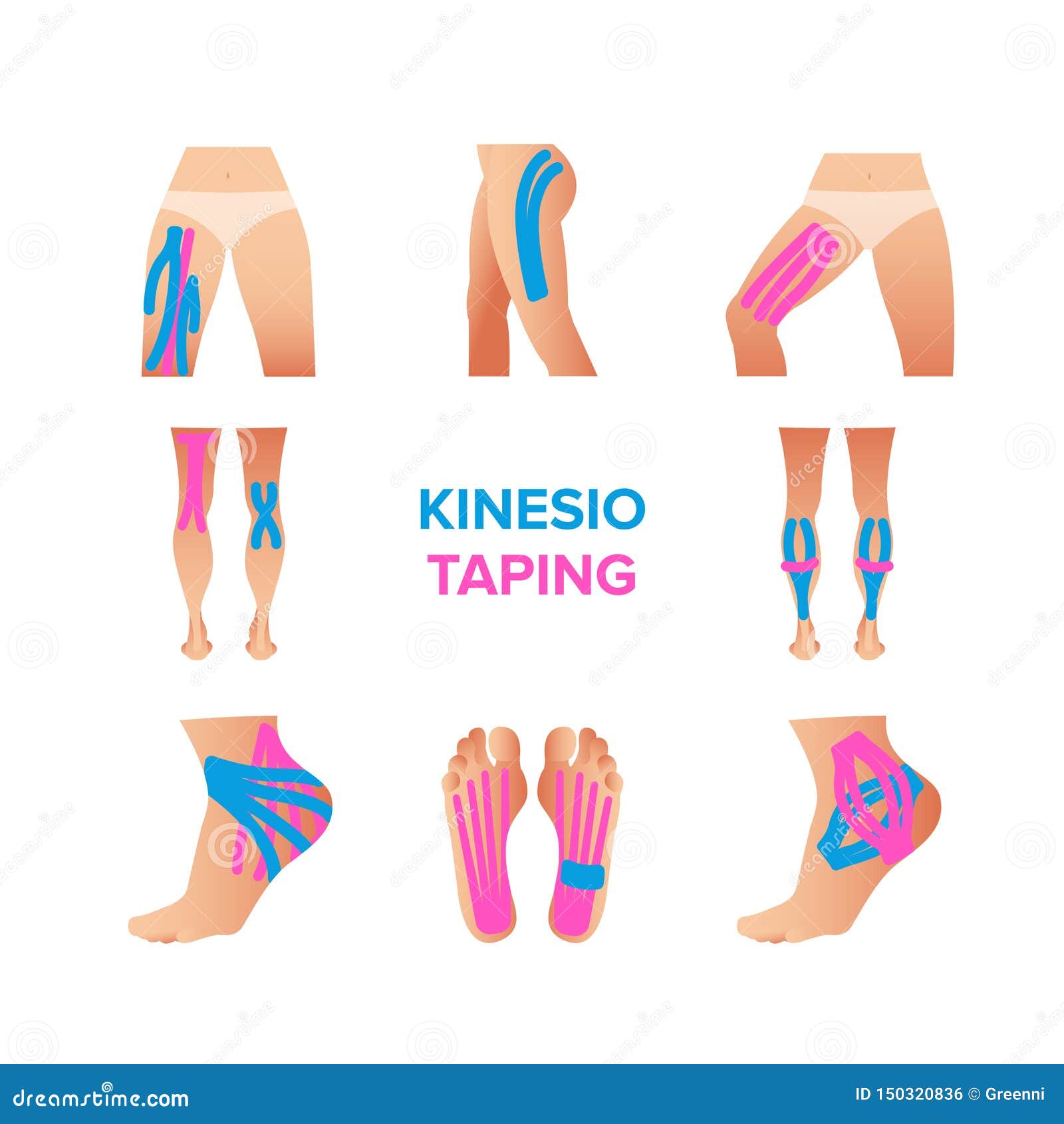 Kinesio Taping Vector Illustrations Stock Vector - Illustration of ... Kinesio Taping Vector Illustrations Stock Vector - Illustration of ...