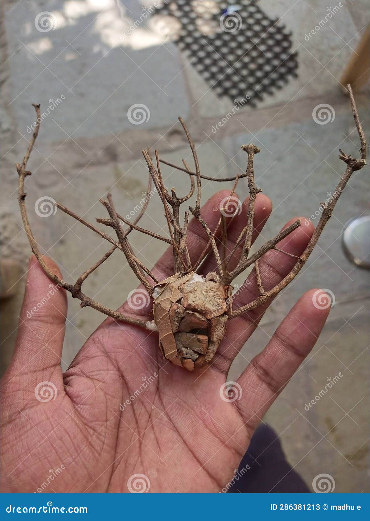 Women Head With Dandruff Caused By The Problem Of Dirty. Or Caused By ...