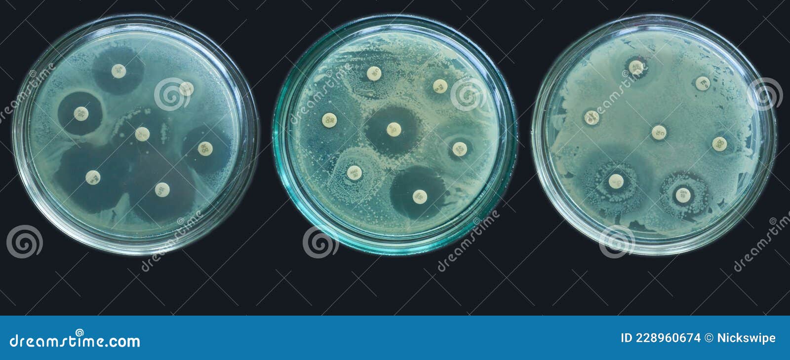 Antimicrobial Resistance Susceptibility Tests by Diffusion Kirby Bauer ... Antimicrobial Resistance Susceptibility Tests by Diffusion Kirby Bauer ...