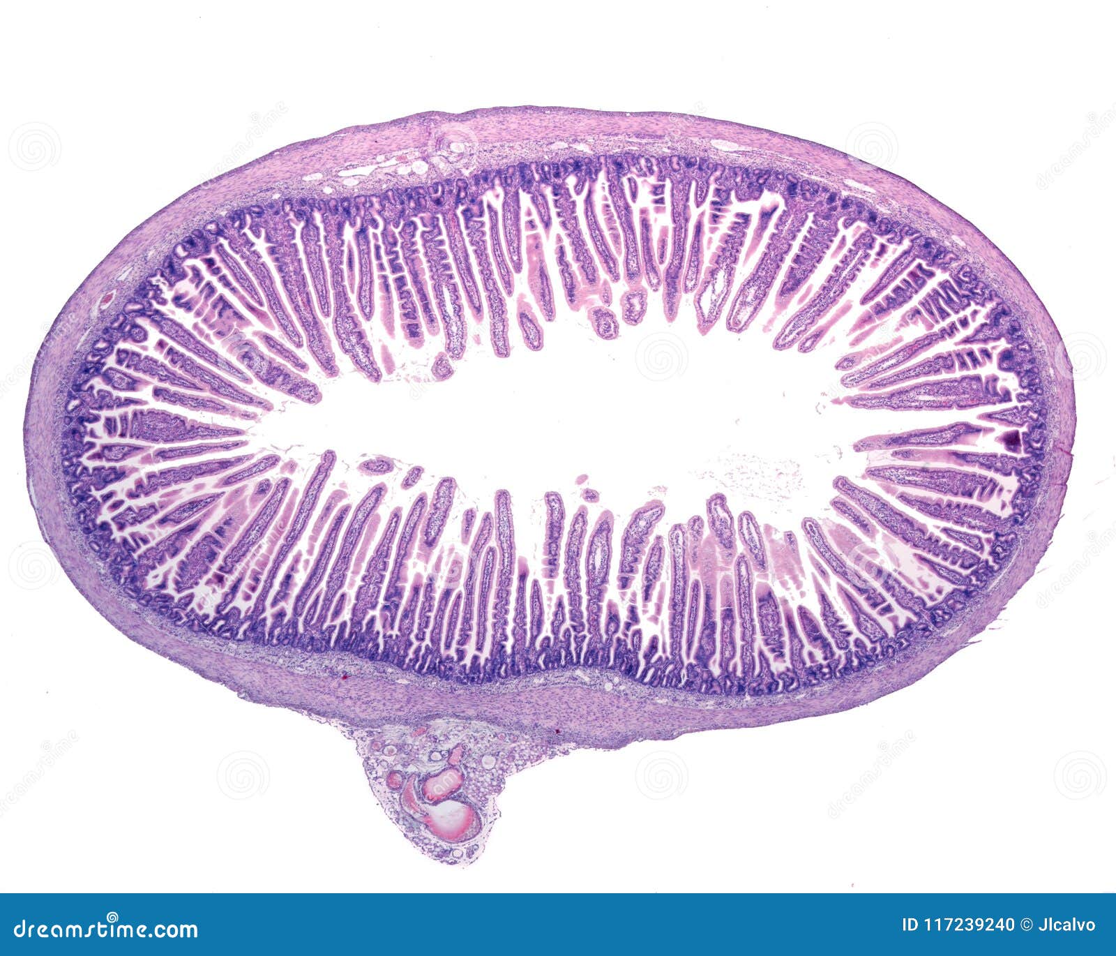 Kleiner Darm Intestinale Darmzotten Stockfoto - Bild von gewebe ...