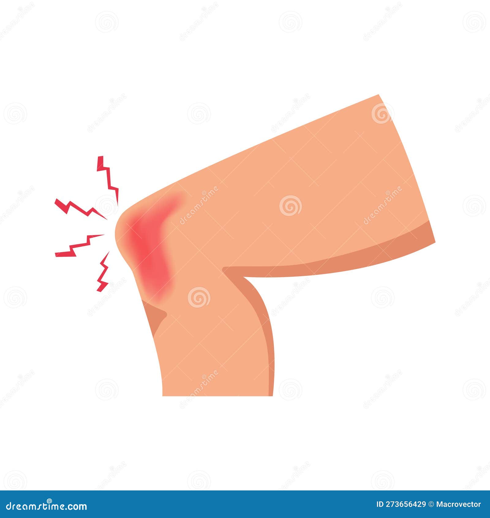 Knee Injury Illustration stock illustration. Illustration of injury ...