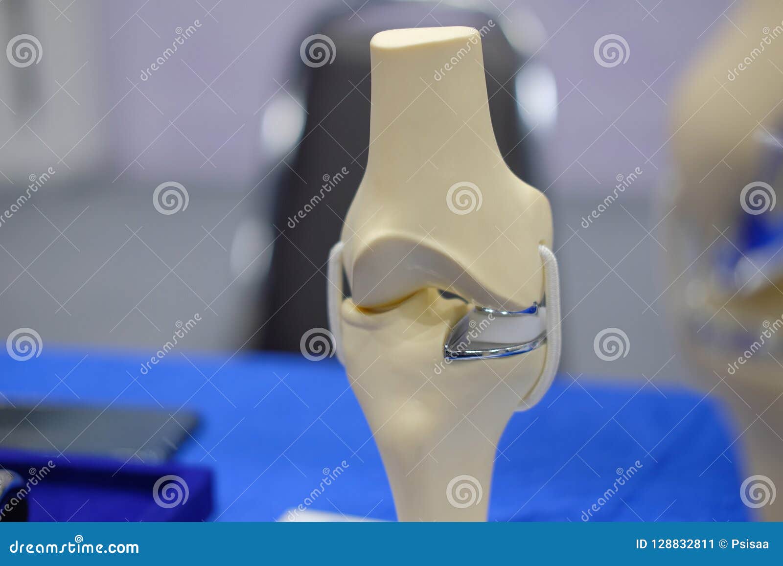 Knee Joint Model after Replacement Surgery Stock Image - Image of ...