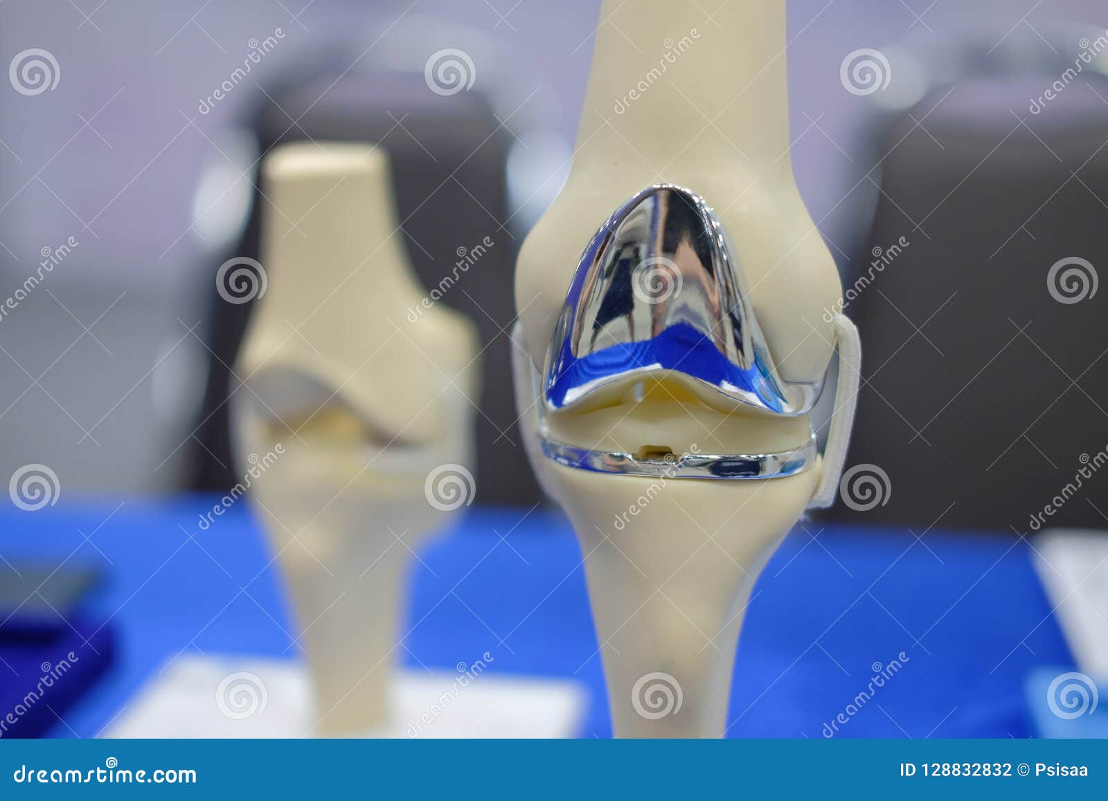 Knee Joint Model after Replacement Surgery Stock Photo - Image of ...