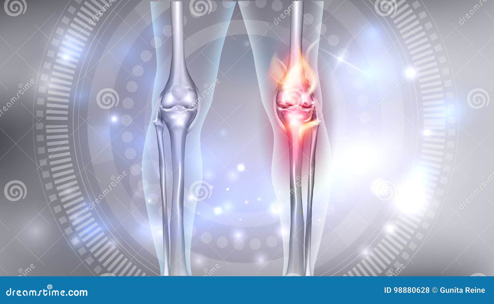 Knee joint problems stock vector. Illustration of anatomy - 98880628