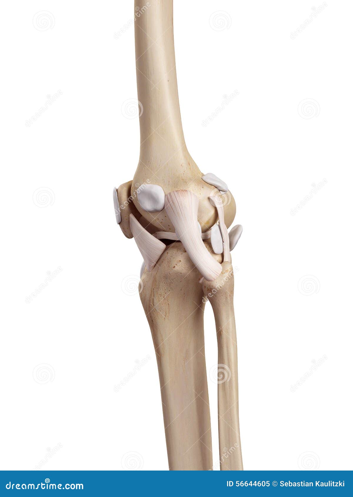 Ligaments Of The Knee_Tear Of The Lateral Collateral Ligament Vector ...