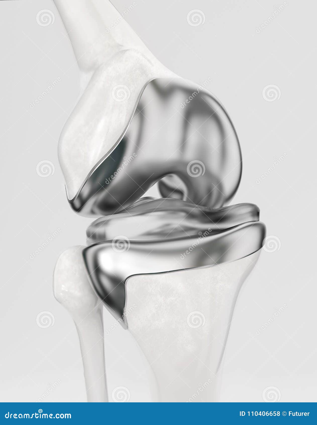 CT Knee 3D Rendering Image AP And Lateral View Isolated On Black ...