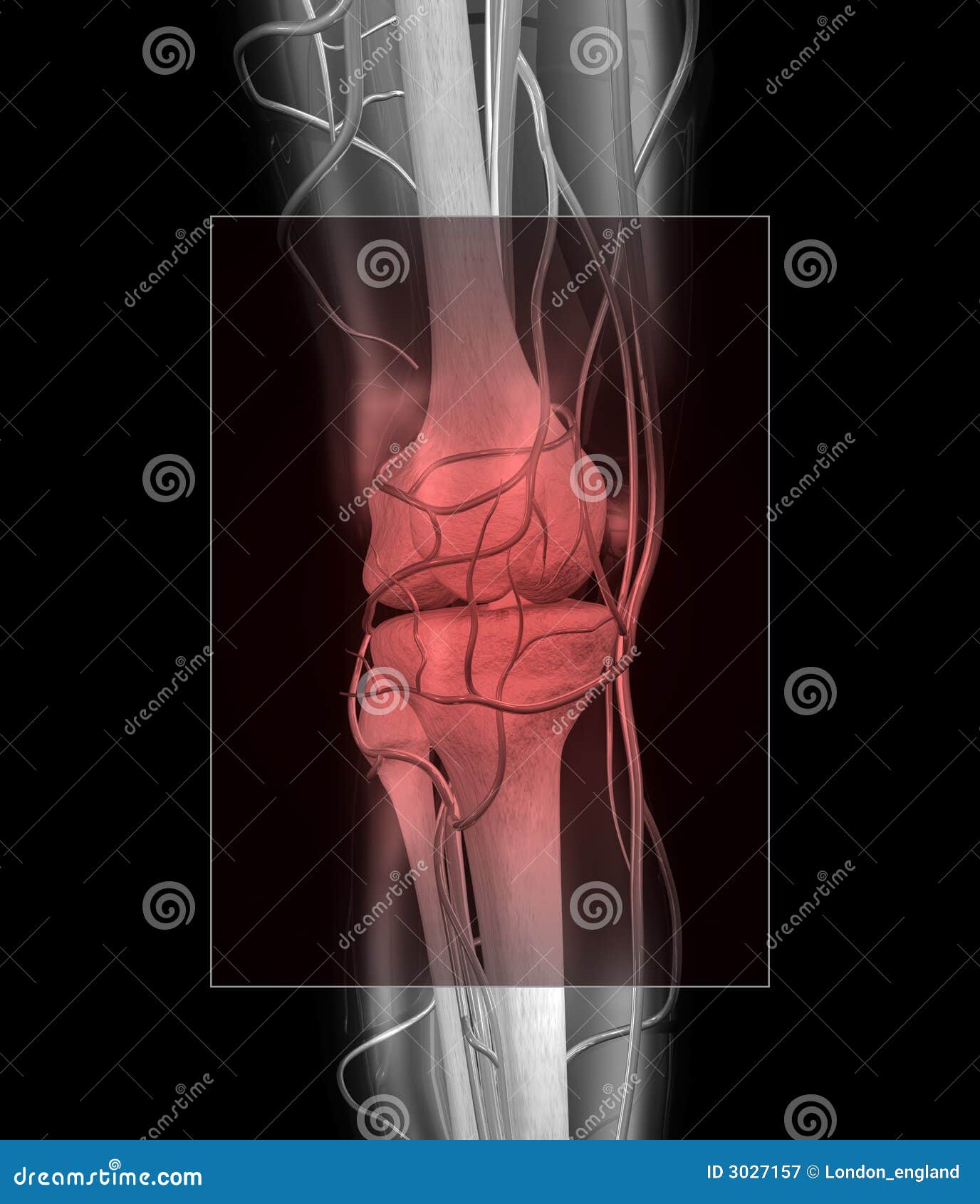 Muscle Pain Line And Solid Icon, Body Pain Concept, Muscle Ache Sign On ...