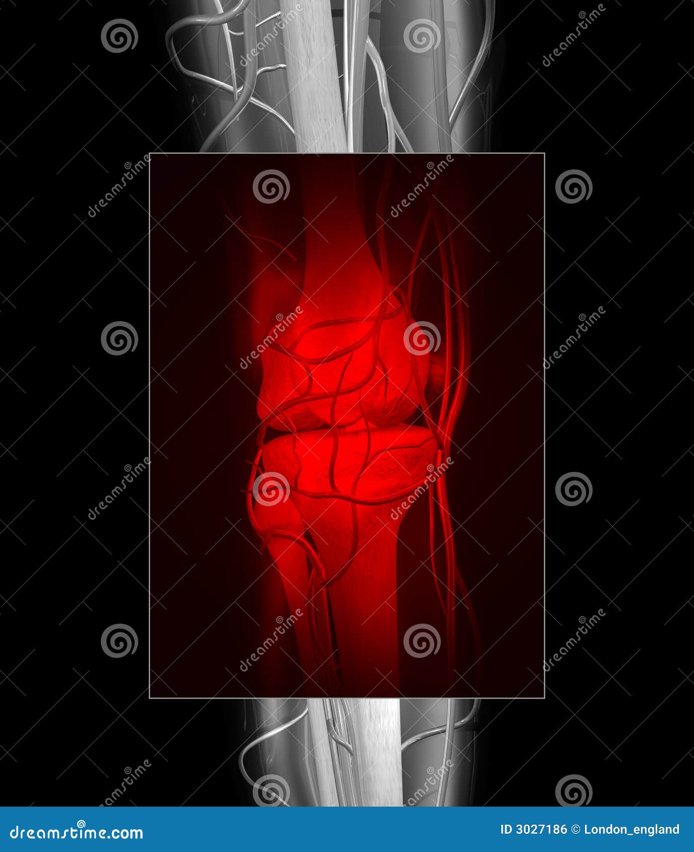 Muscle Pain Line And Solid Icon, Body Pain Concept, Muscle Ache Sign On ...
