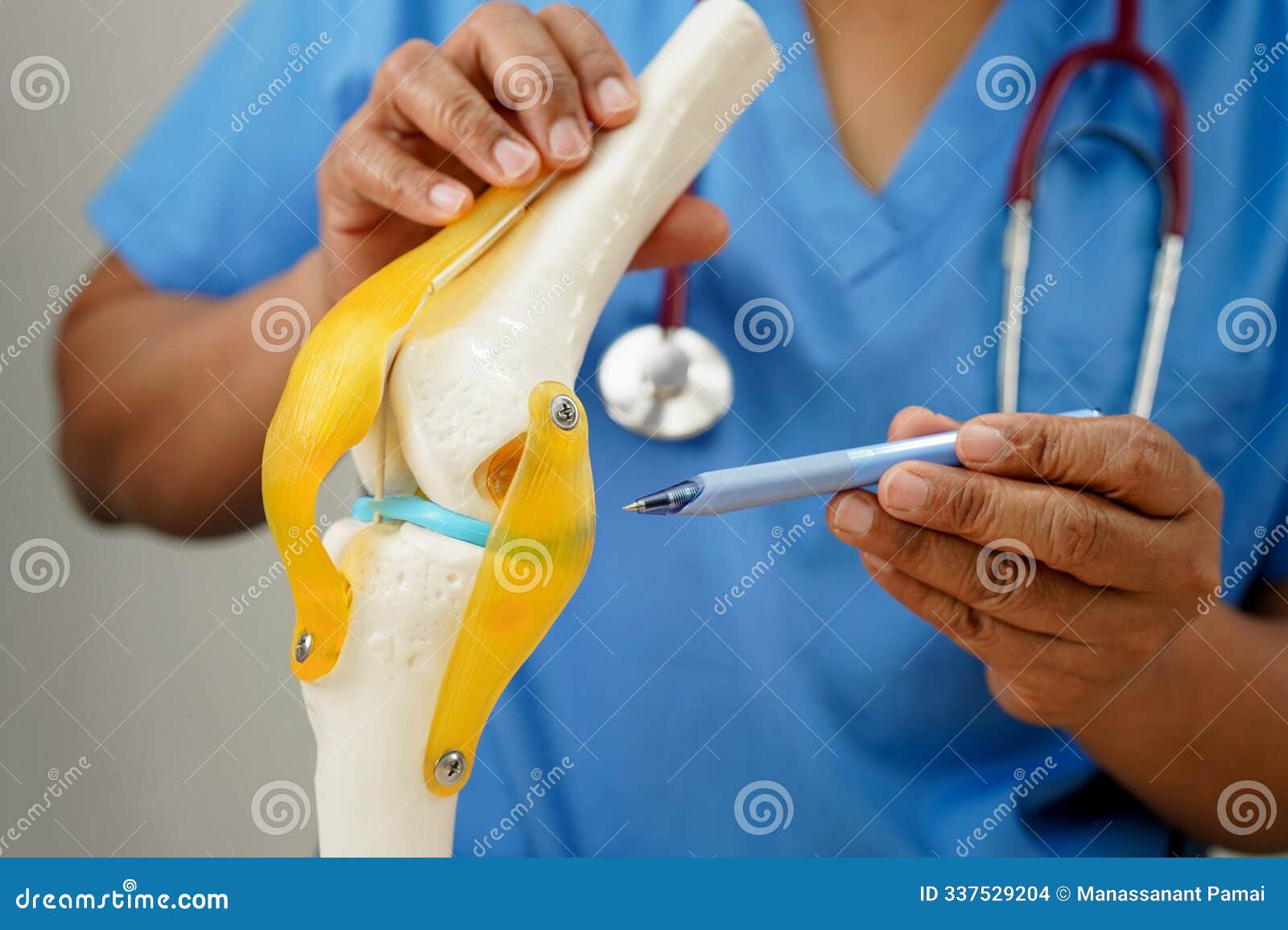 Knee Osteoarthritis, Doctor Showing Model Knee Joint Orthopedic Stock ...