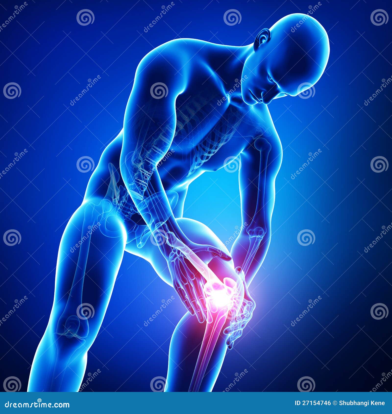 Knee Pain. X-ray Of The Skeleton And Legs. Anatomical Body Of A Seated ...
