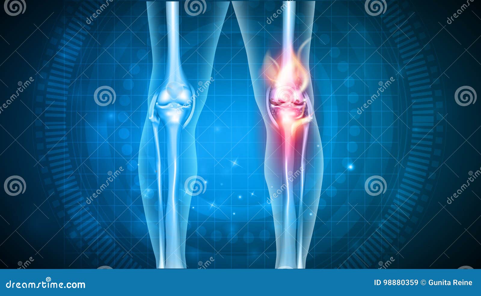 Knee pain abstract design stock vector. Illustration of injury - 98880359