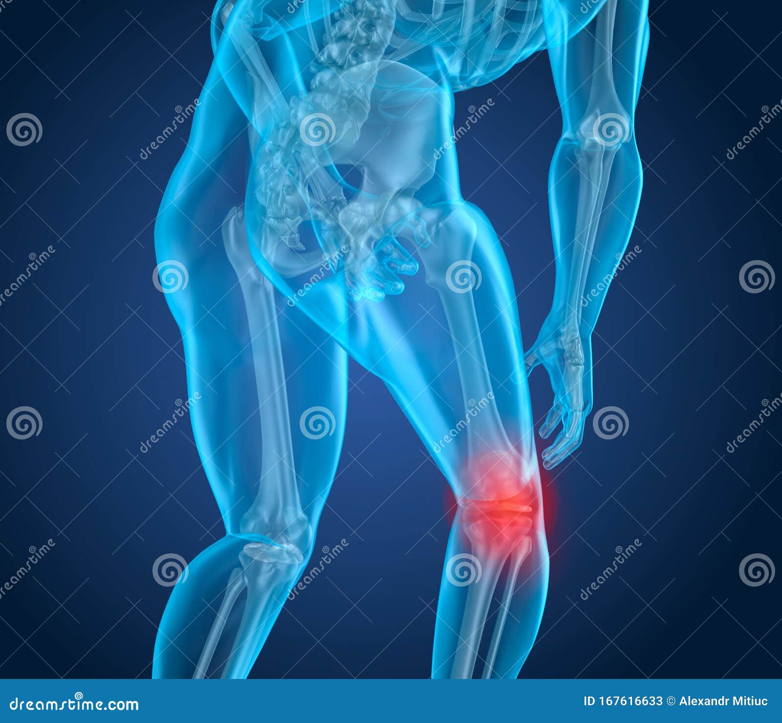 Knee Pain Attack, Man Suffering from Spinal Knee. 3D Illustration Stock ...
