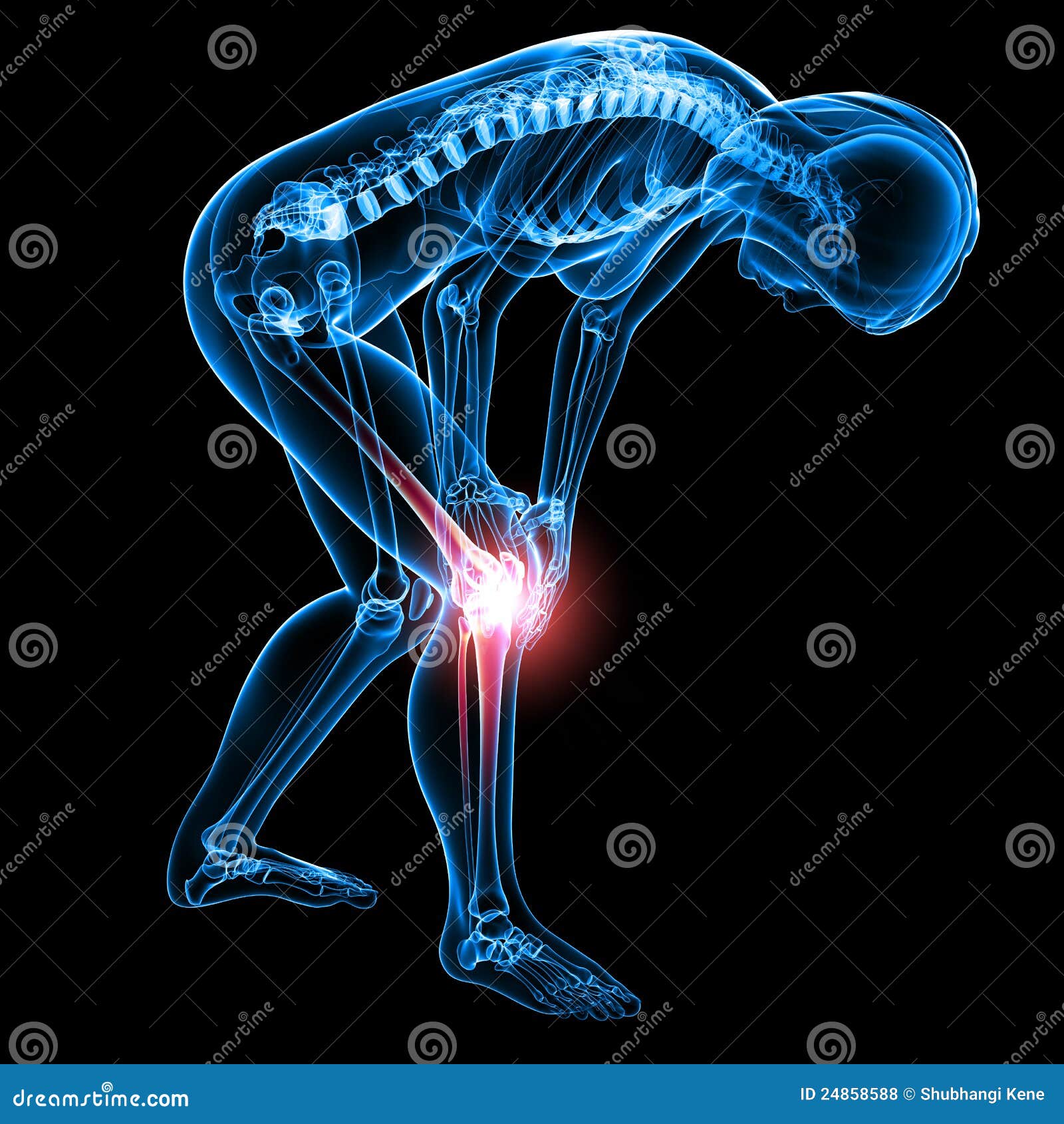 Pain Ray Stock Illustrations – 11,791 Pain Ray Stock Illustrations ...