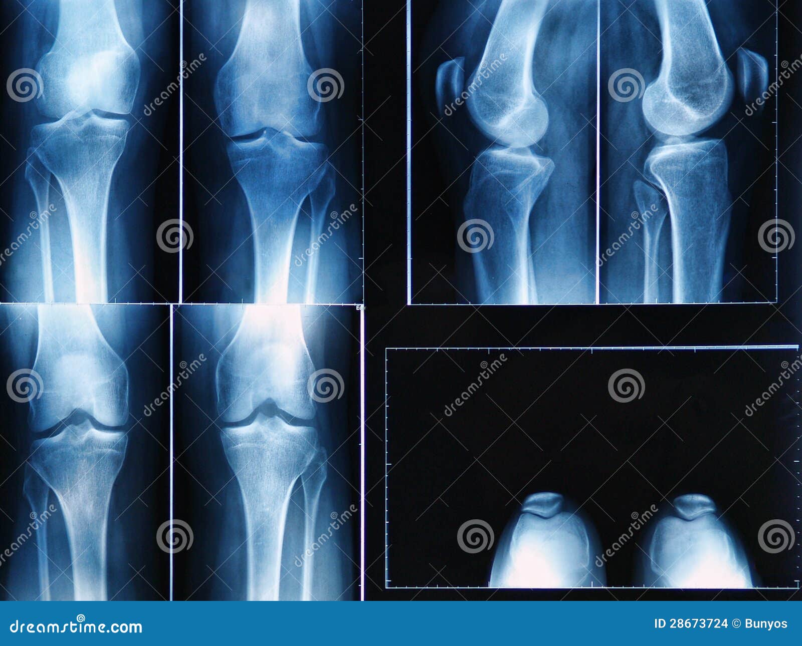 Knee x-ray stock illustration. Illustration of exam, healthcare - 28673724