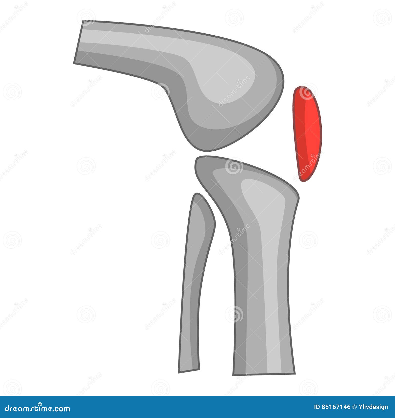 Knee Replacement Implant Icon, Cartoon Style Stock Vector ...