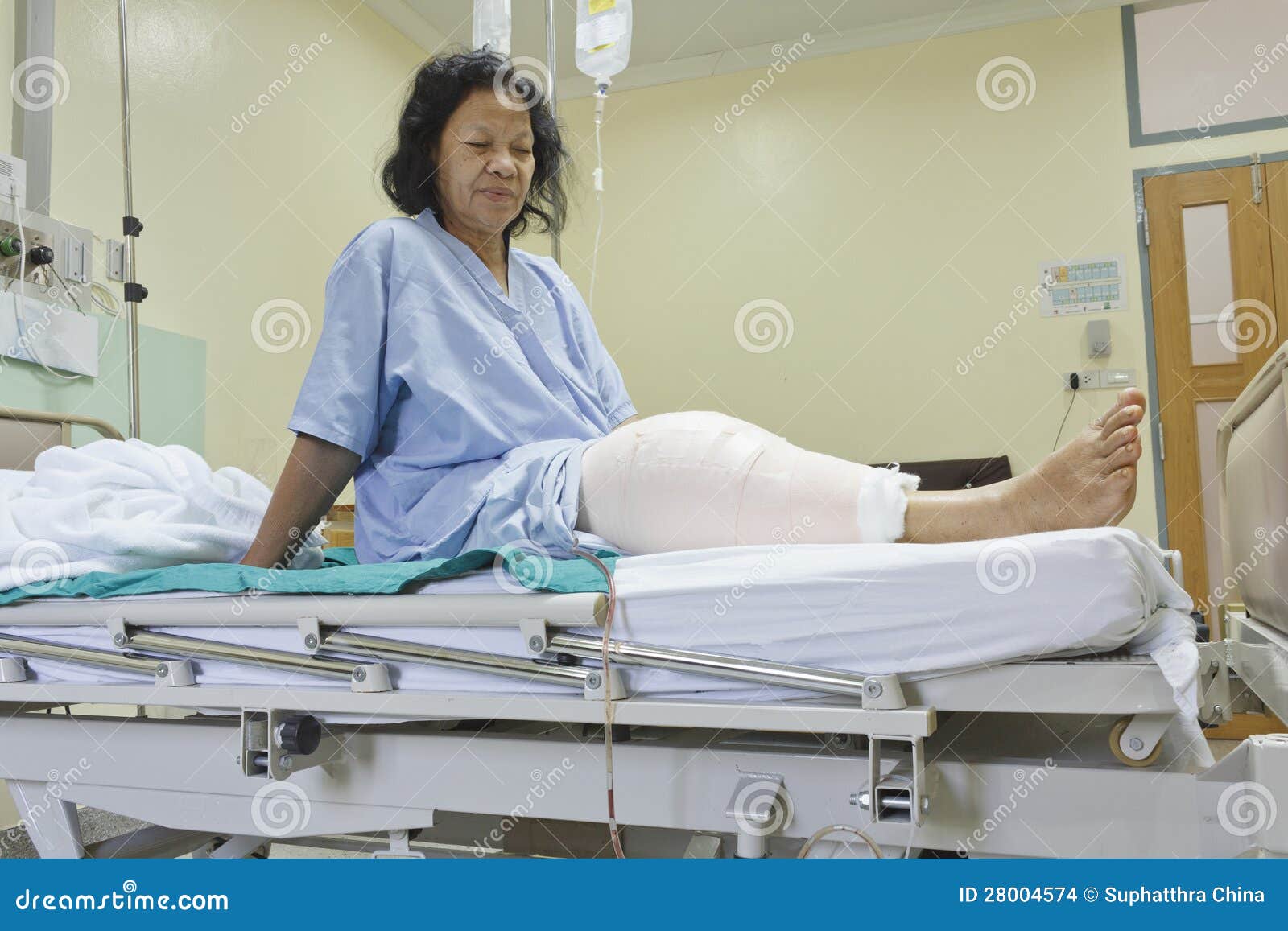 Knee replacement incision stock photo. Image of hospital - 28004574
