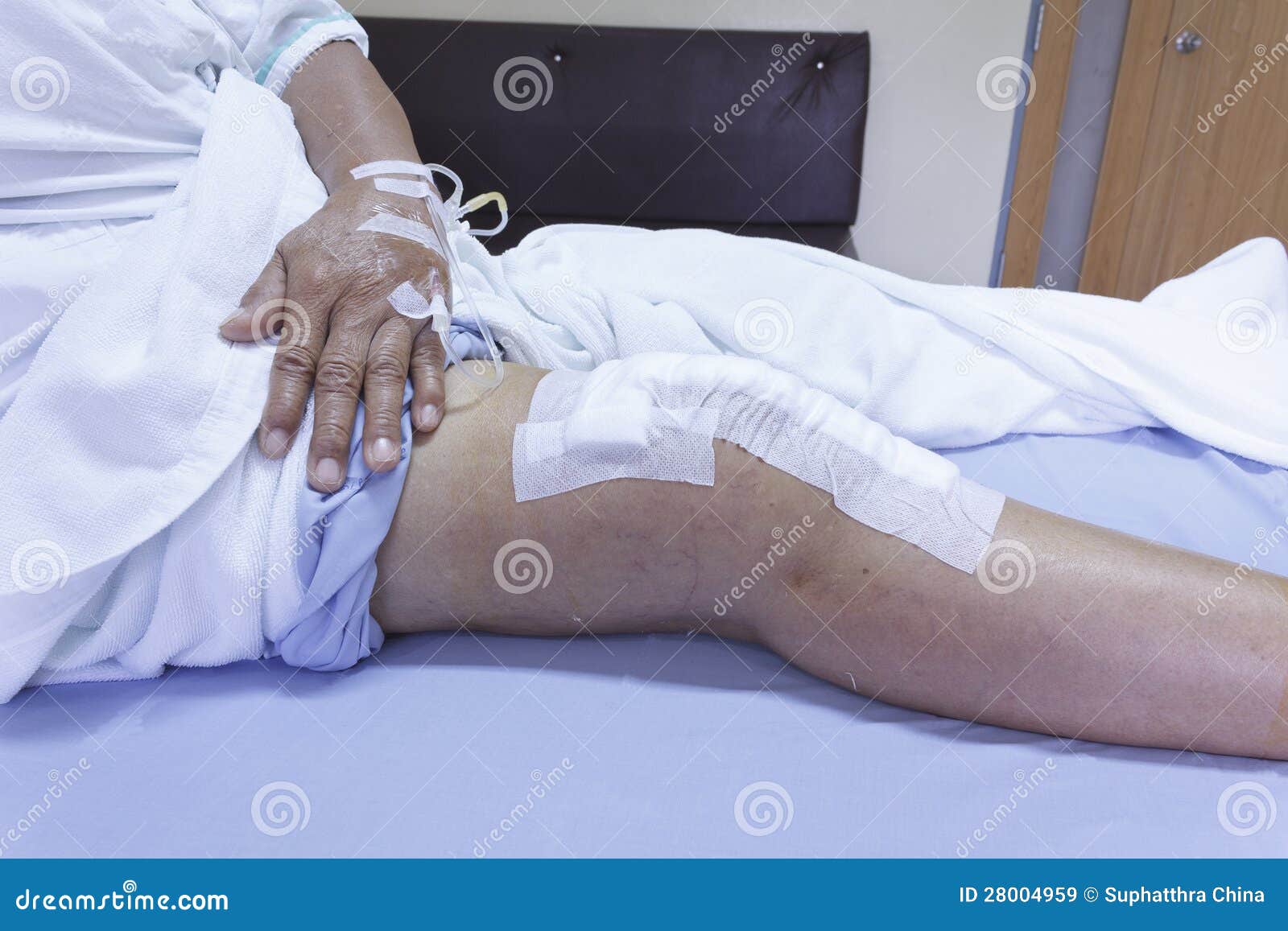Knee replacement incision stock image. Image of adult - 28004959