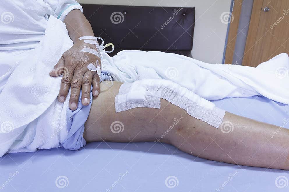 Knee replacement incision stock image. Image of adult - 28004959