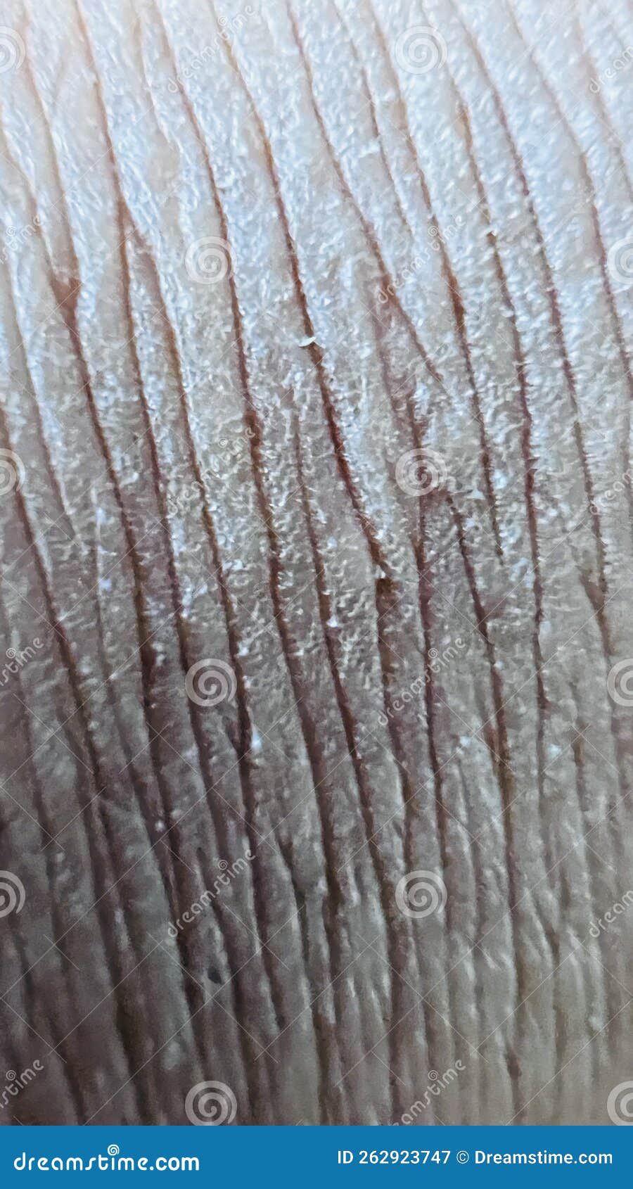 Knee skin stock image. Image of original, macro, knee - 262923747
