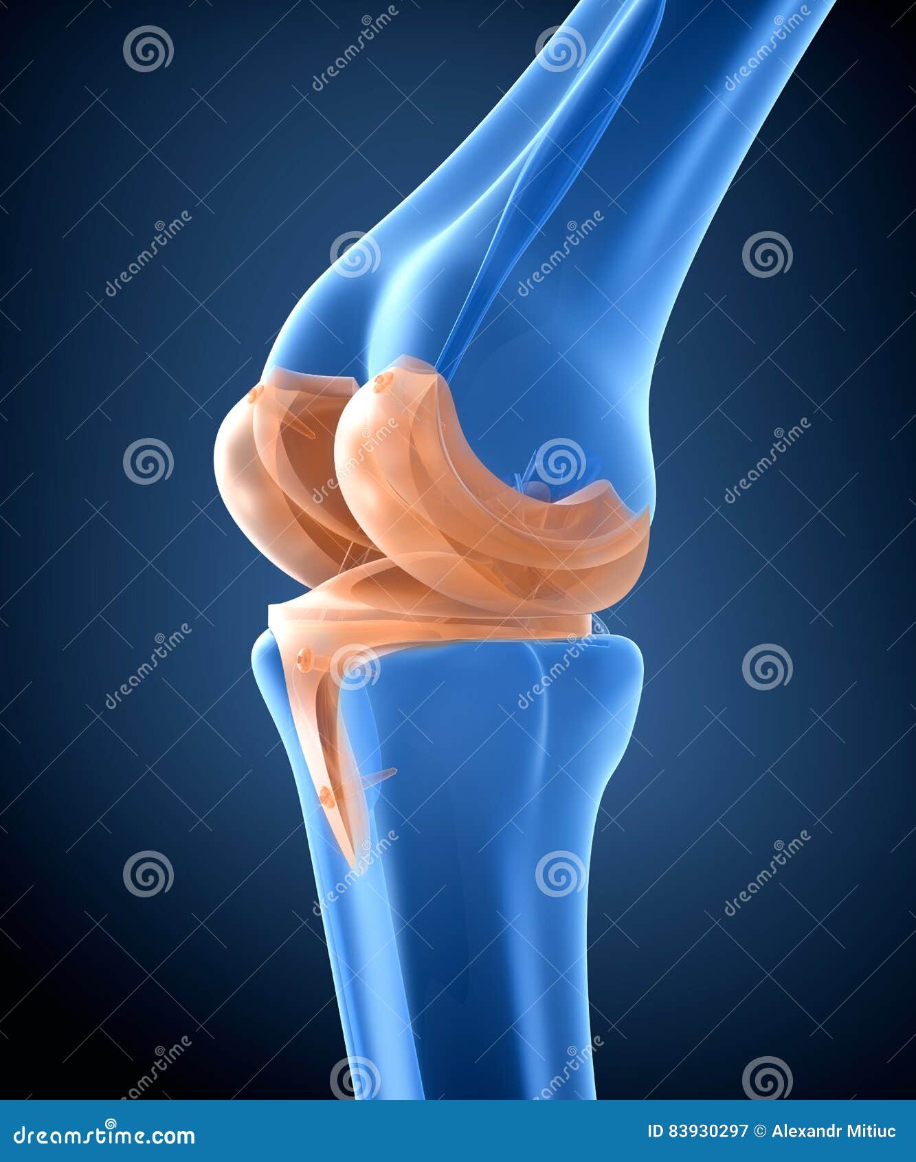 Knee and Titanium Hinge Joint. 3D Illustration Stock Illustration ...