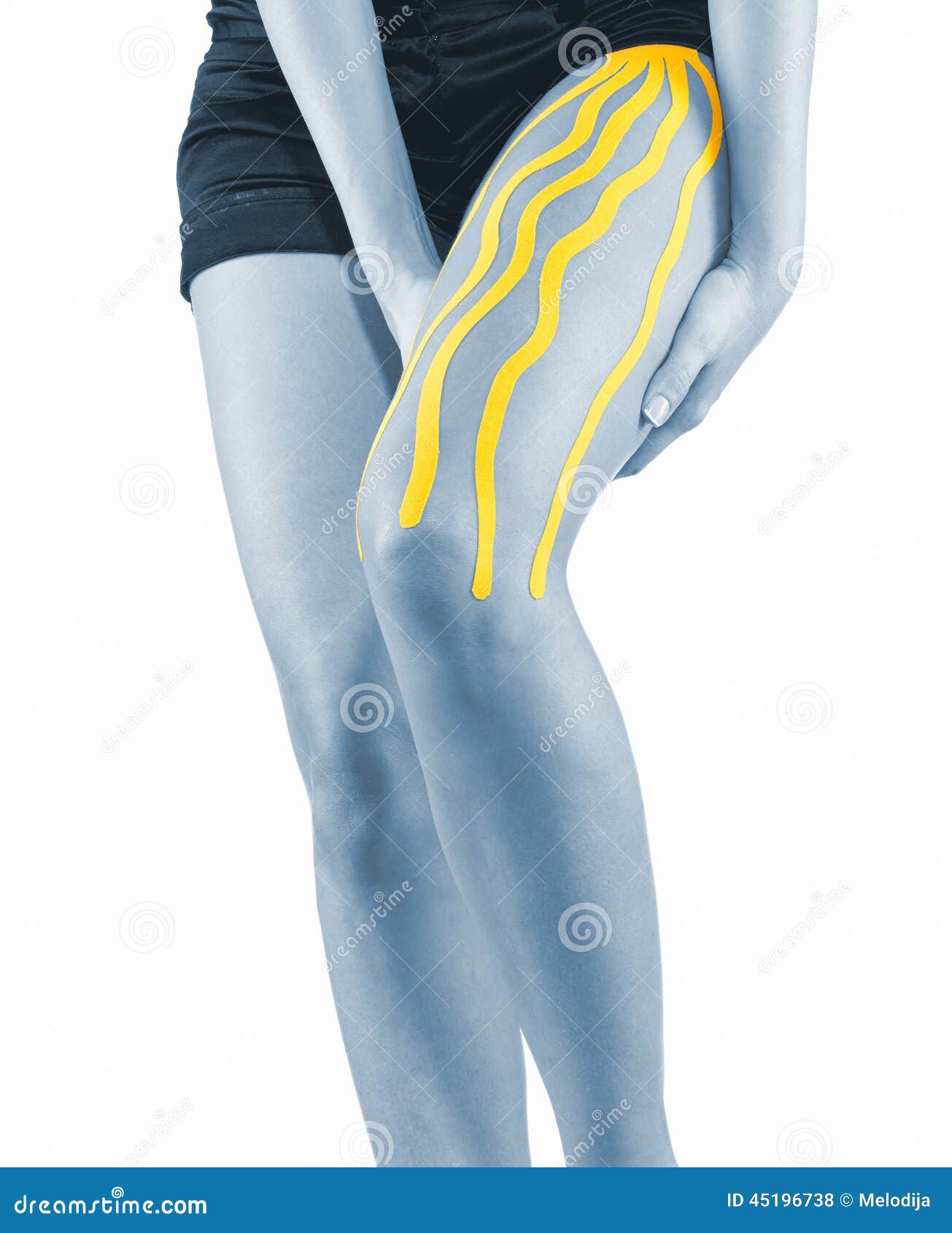 Knee Treated with Tape Therapy Stock Photo - Image of athletic ...