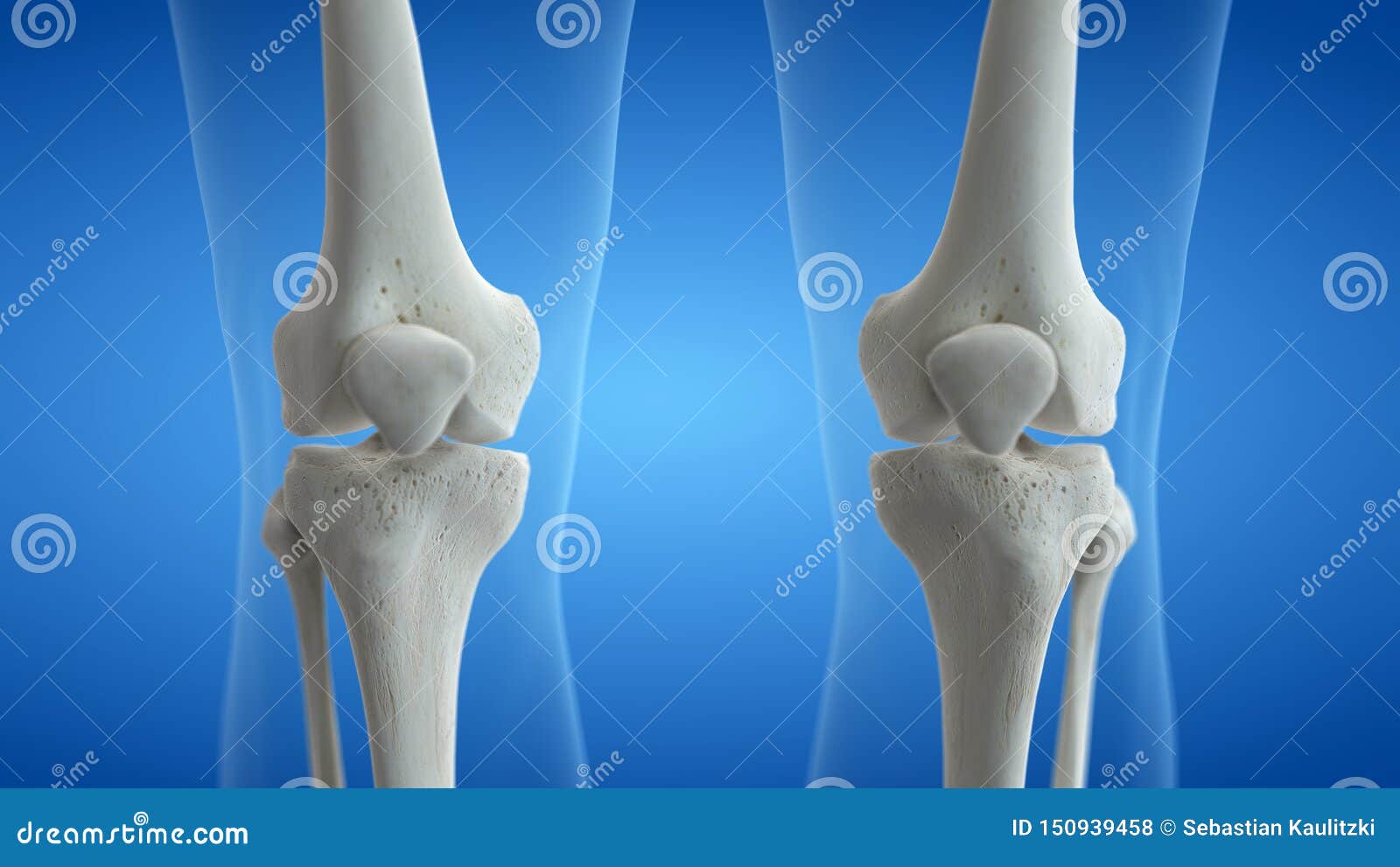The knees stock illustration. Illustration of medical - 150939458