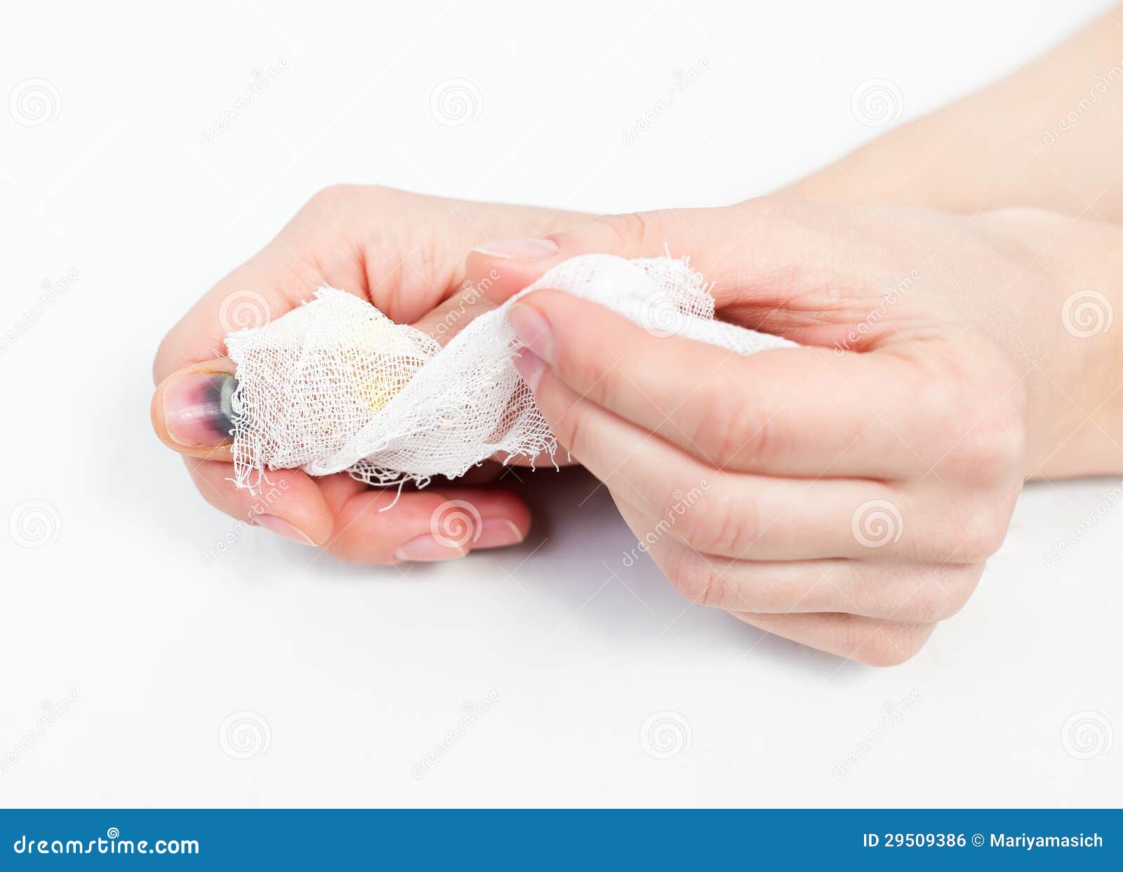 Kneuzing op spijker stock foto. Image of schade, purper - 29509386