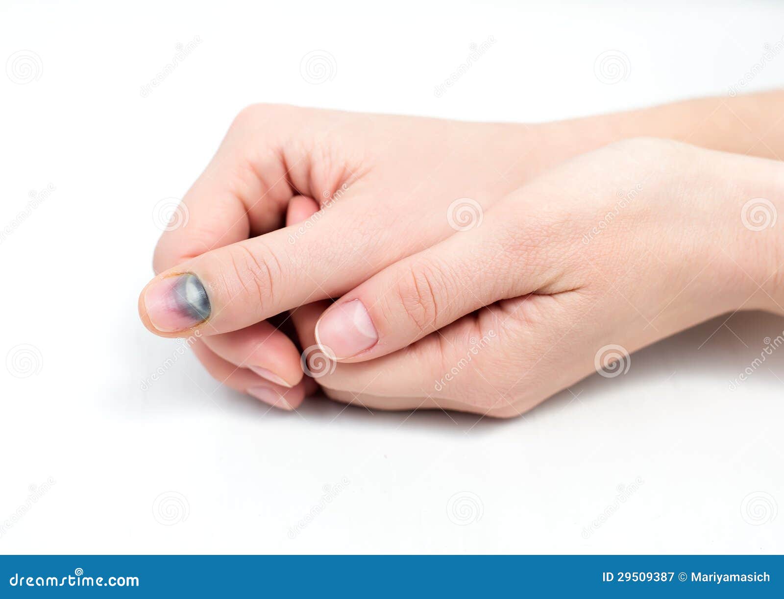 Kneuzing op spijker stock afbeelding. Image of ziekenhuis - 29509387