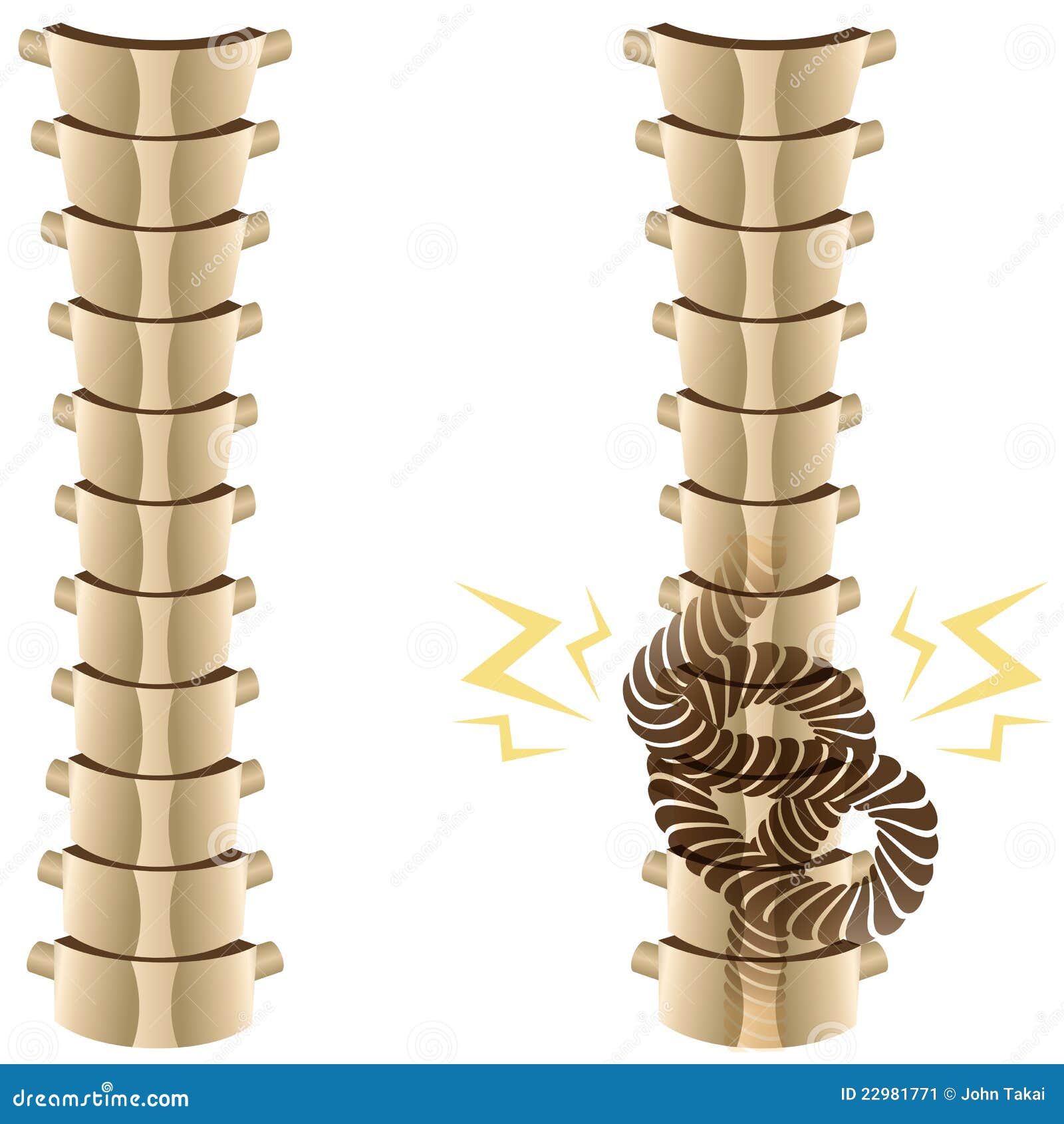 Knotted Spine stock vector. Illustration of spinal, isolated - 22981771