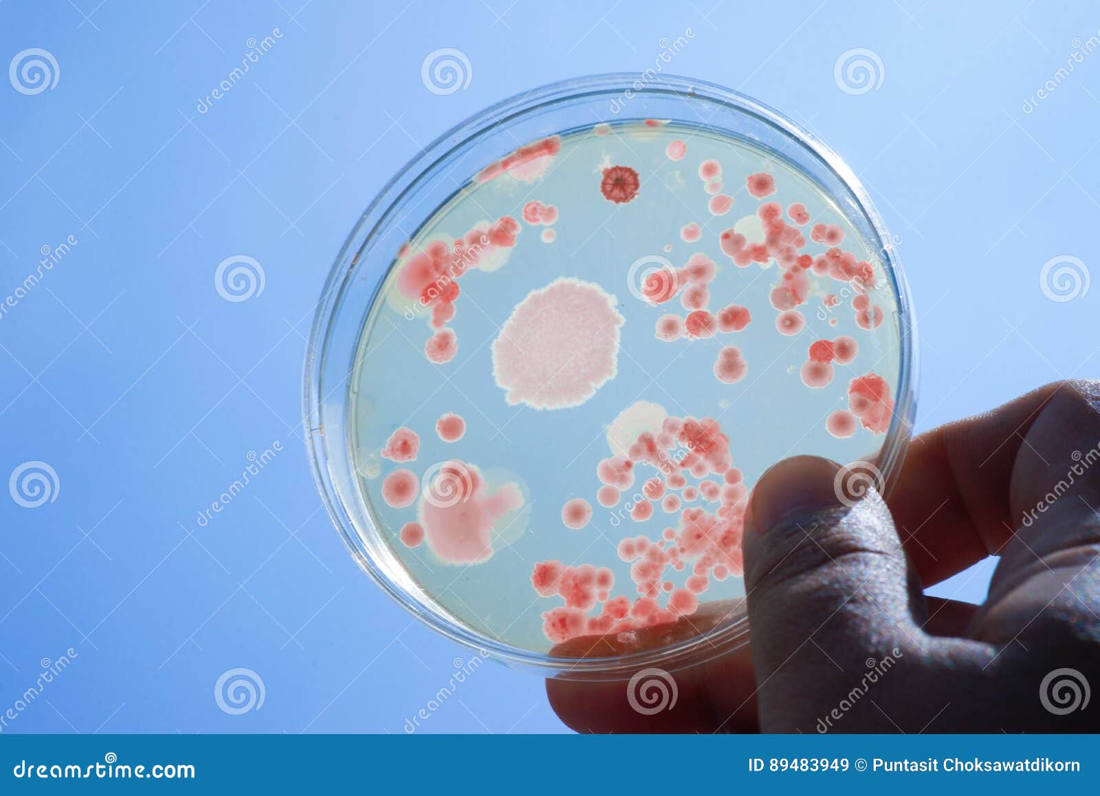 Kolonie Van Bacteriën in De Plaat Van Het Cultuurmiddel Stock ...