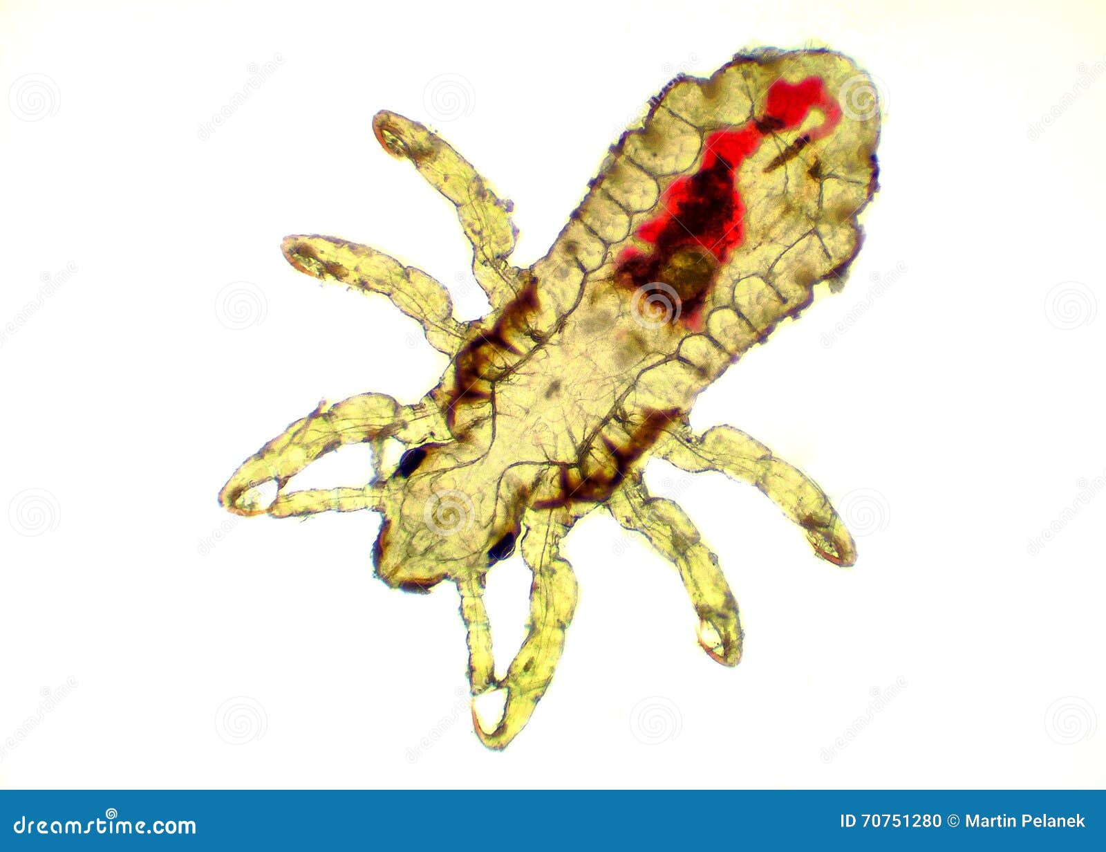 Kopflaus - Pediculus Capitis, Mikroskopbild Stockfoto - Bild von läuse ...