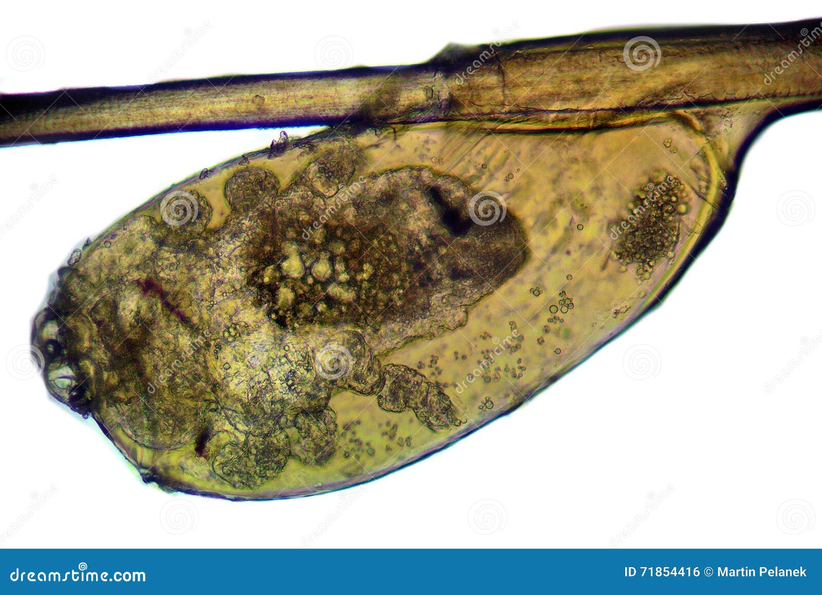 Kopflaus - Pediculus Capitis, Mikroskopbild Stockfoto - Bild von bissen ...