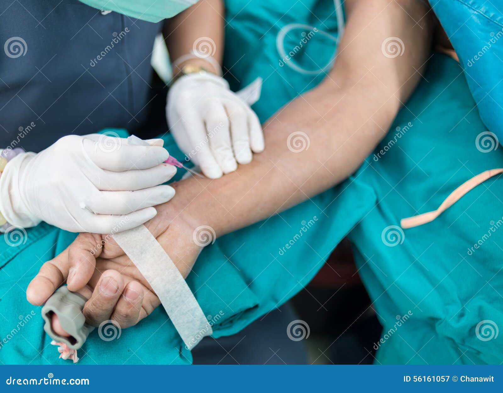 Línea arterial imagen de archivo. Imagen de sangre, anestesia - 56161057