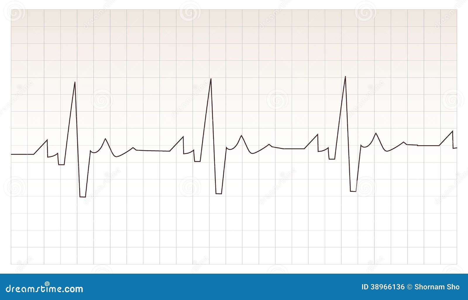 Línea de vida stock de ilustración. Ilustración de cuidado - 38966136