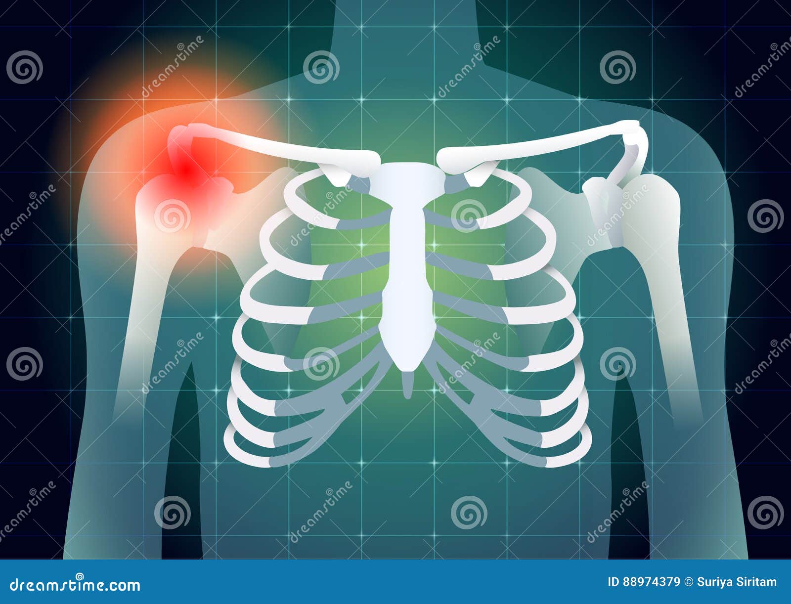 L'osso Di Spalla Ha Un Segnale Rosso Illustrazione Vettoriale ...