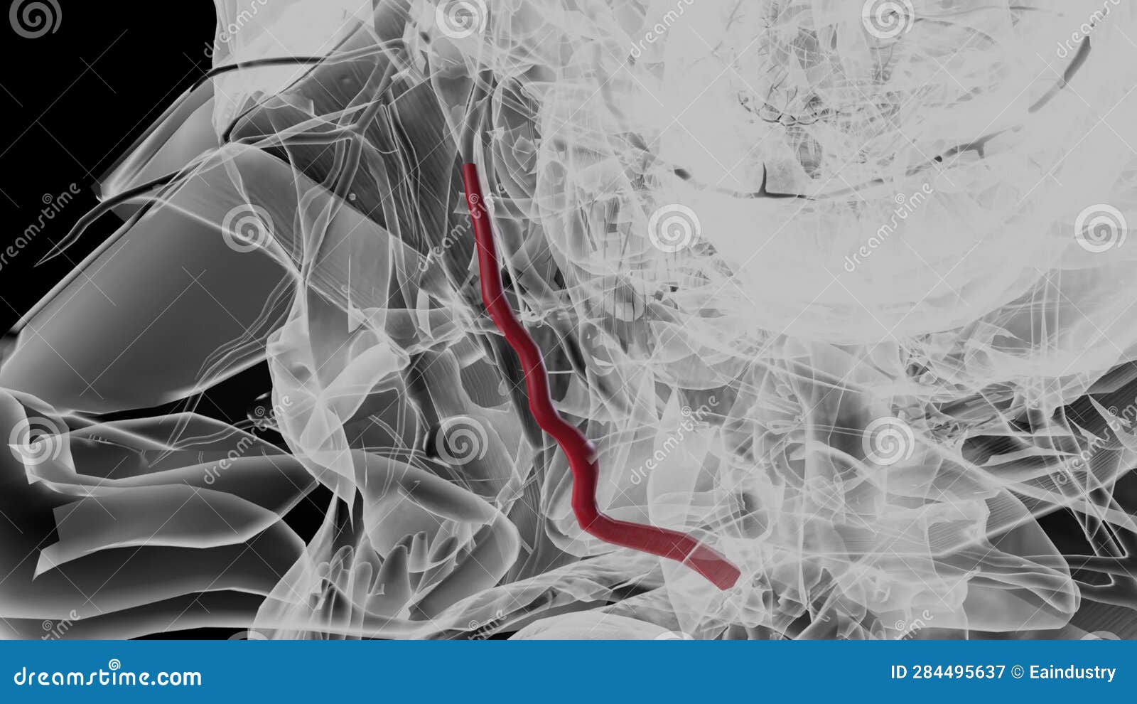 La Arteria Angular Es Una Arteria De La Cara Almacen De Video - Vídeo ...