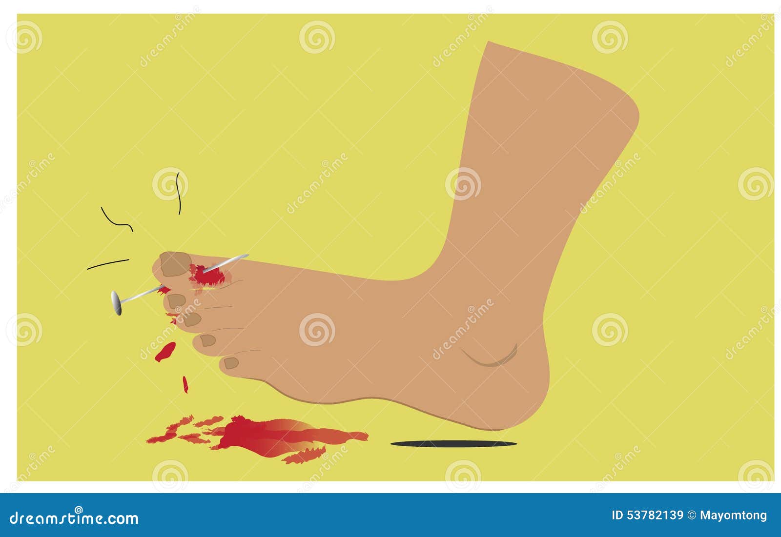 La blessure de pied illustration de vecteur. Illustration du main ...