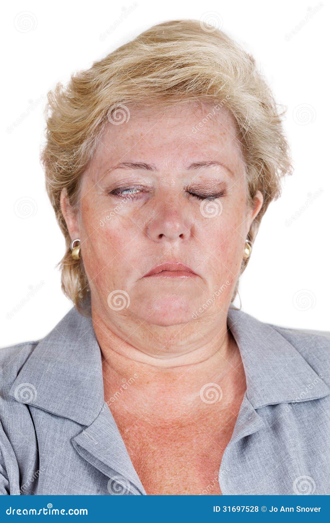 La Paralysie De Bell - L'oeil Ne Se Fermera Pas Photo stock - Image du ...