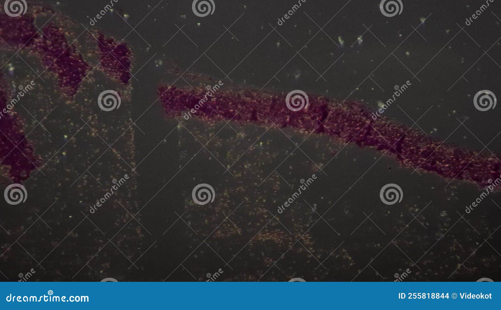 Lab Slide with Three Types of Bacteria Magnified in 200 Times Under ...