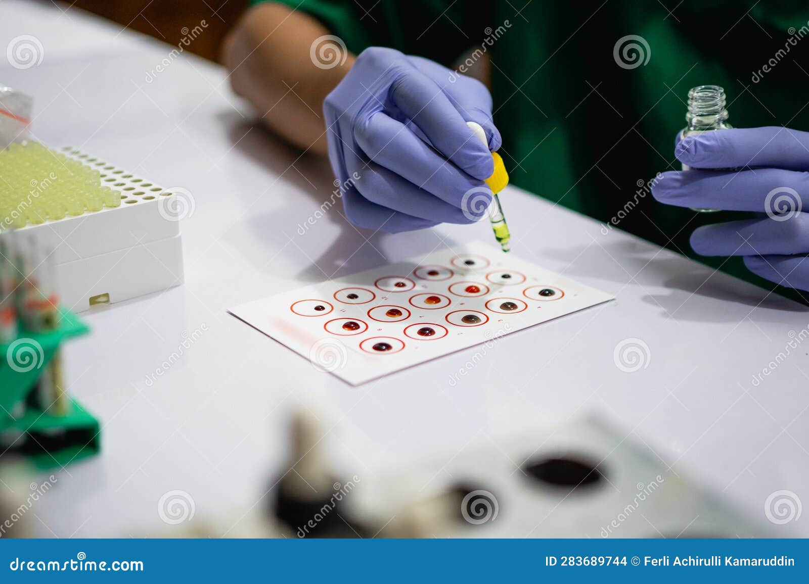 Lab Tech Wearing Gloves Mixes Blood with Serum To Test Blood Type Stock ...
