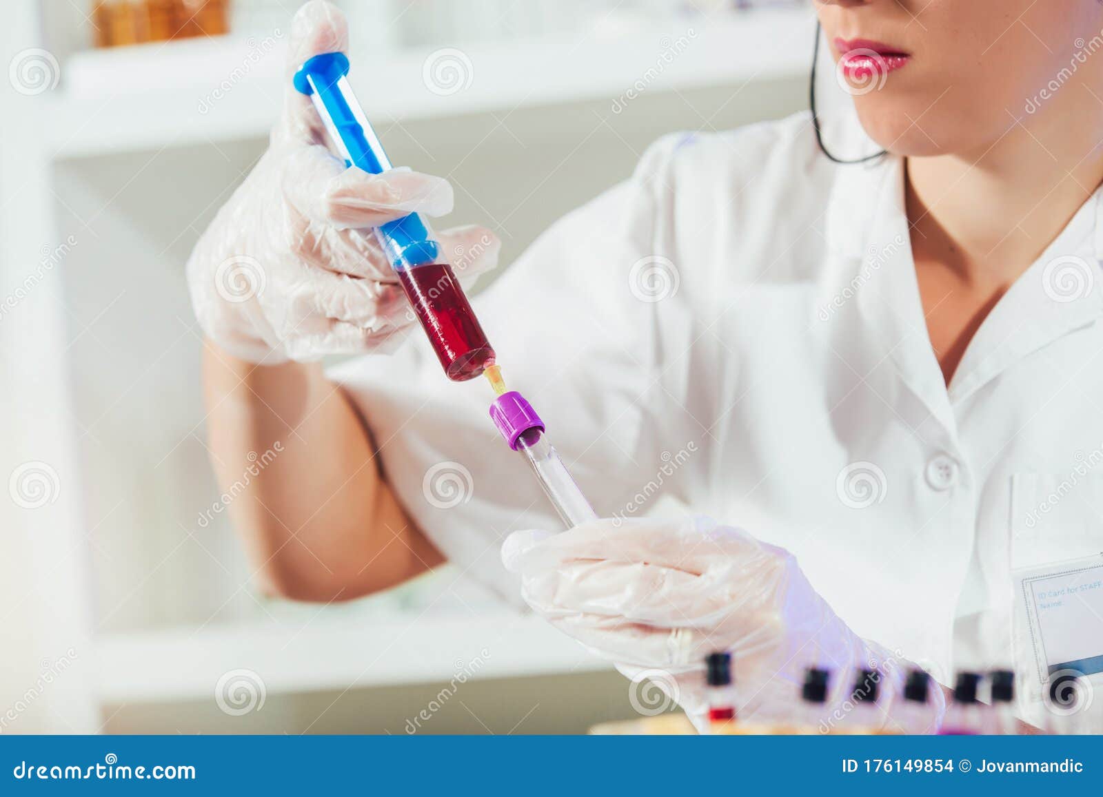 Lab Technician Assistant Analyzing a Blood Sample at Laboratory. Stock ...