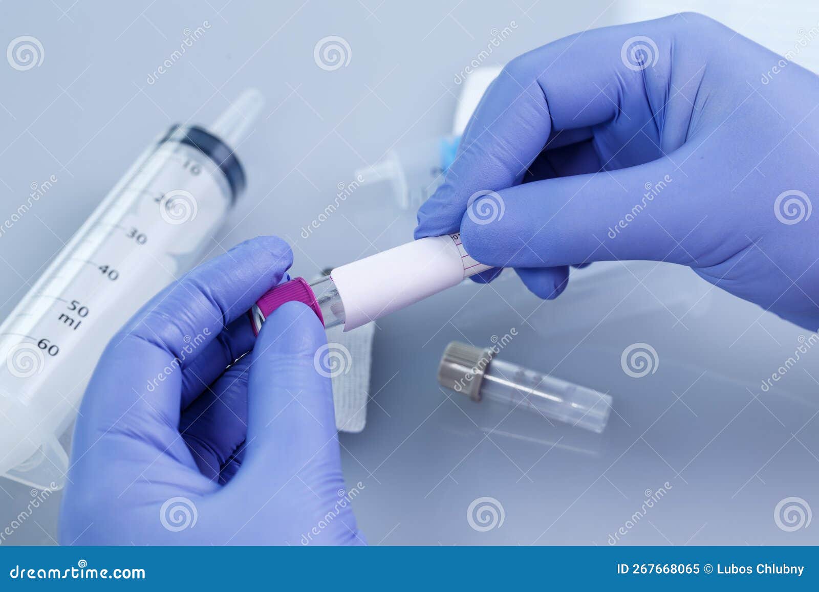 Lab Technician Holds a Collection Tube for a Blood Test Stock Image ...