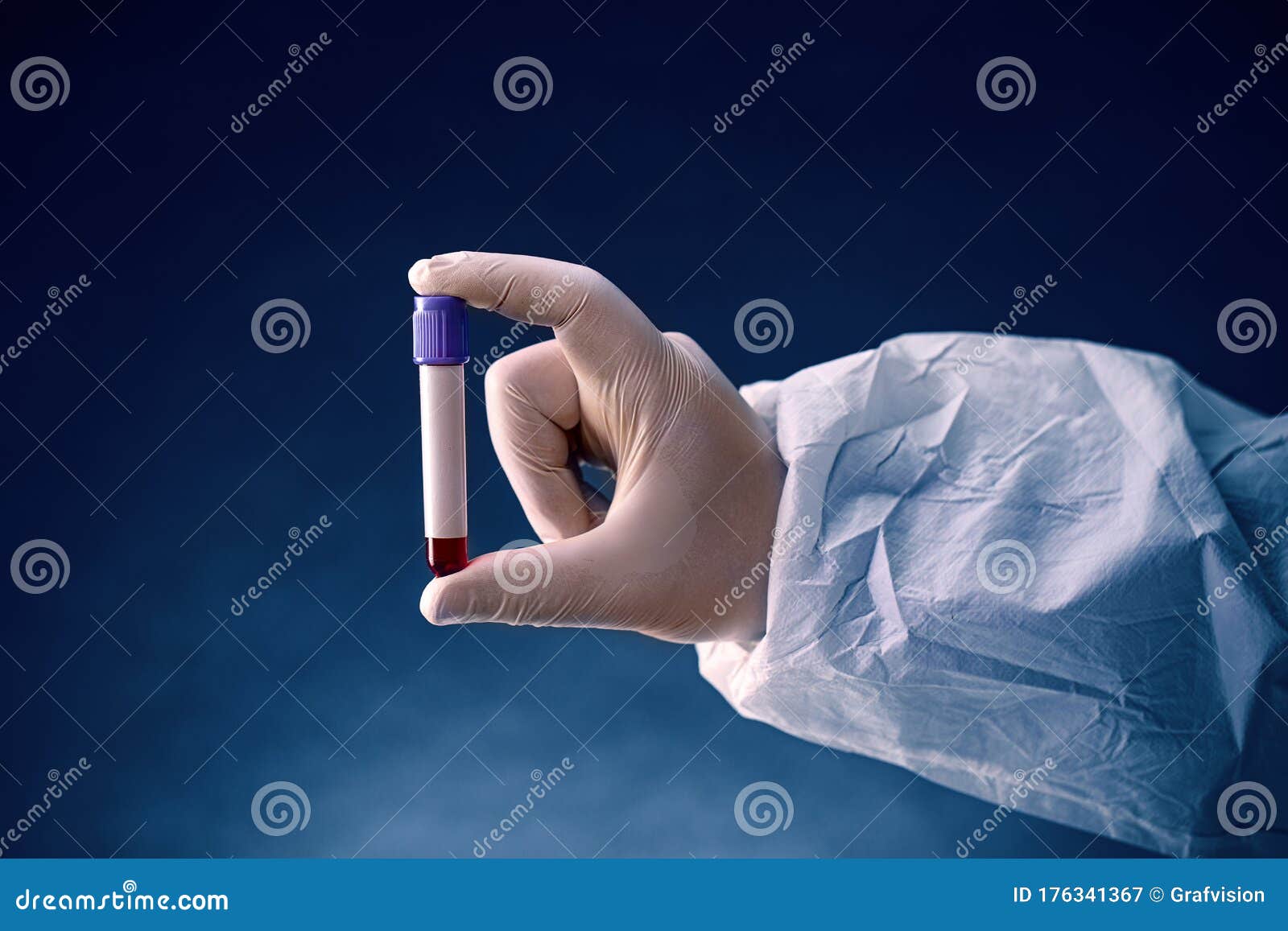 Lab Technician with a Tube of Blood Stock Image - Image of discovery ...