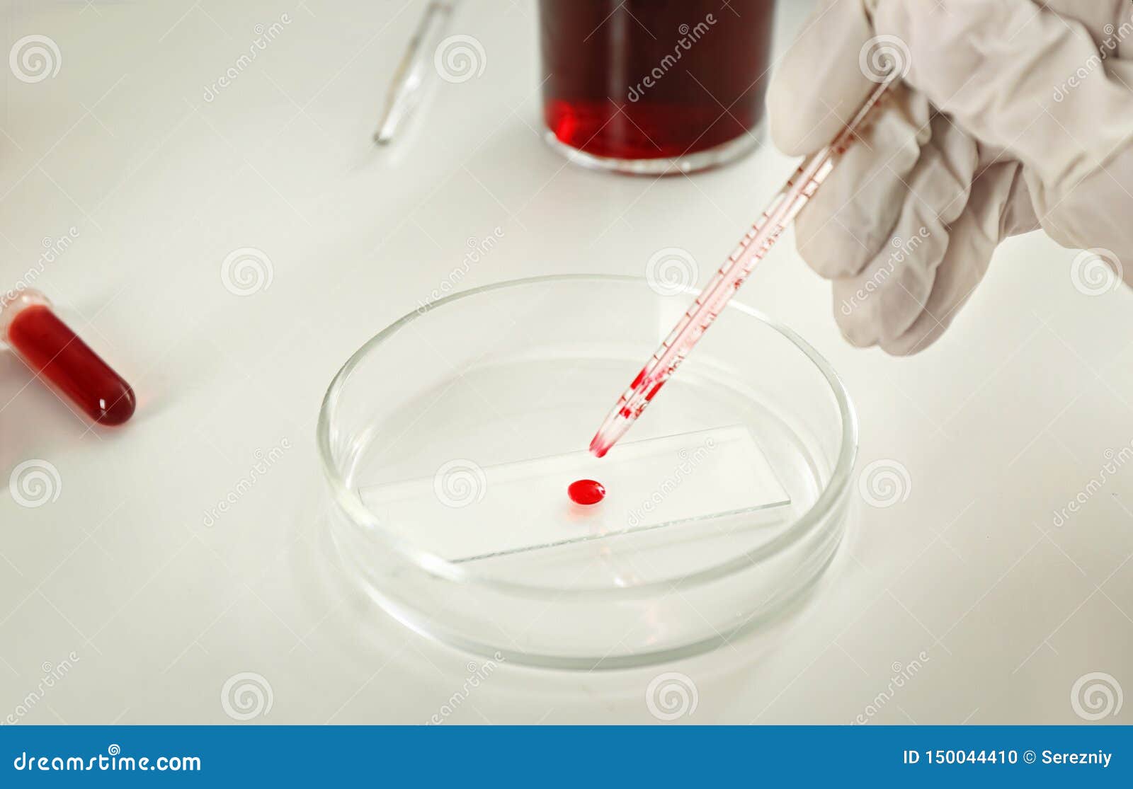 Lab Worker Dripping Blood in Petri Dish on Table Stock Photo - Image of ...