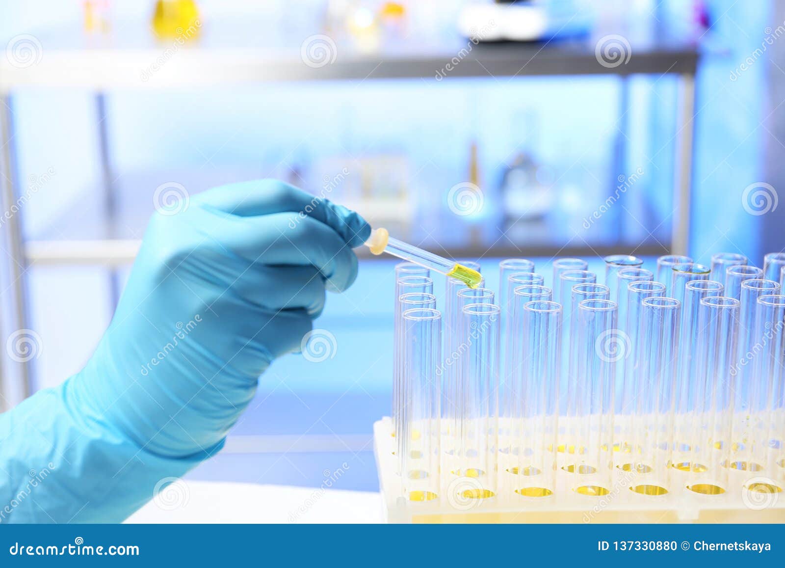 Laboratory Assistant Dripping Urine Sample for Analysis from Pipette ...