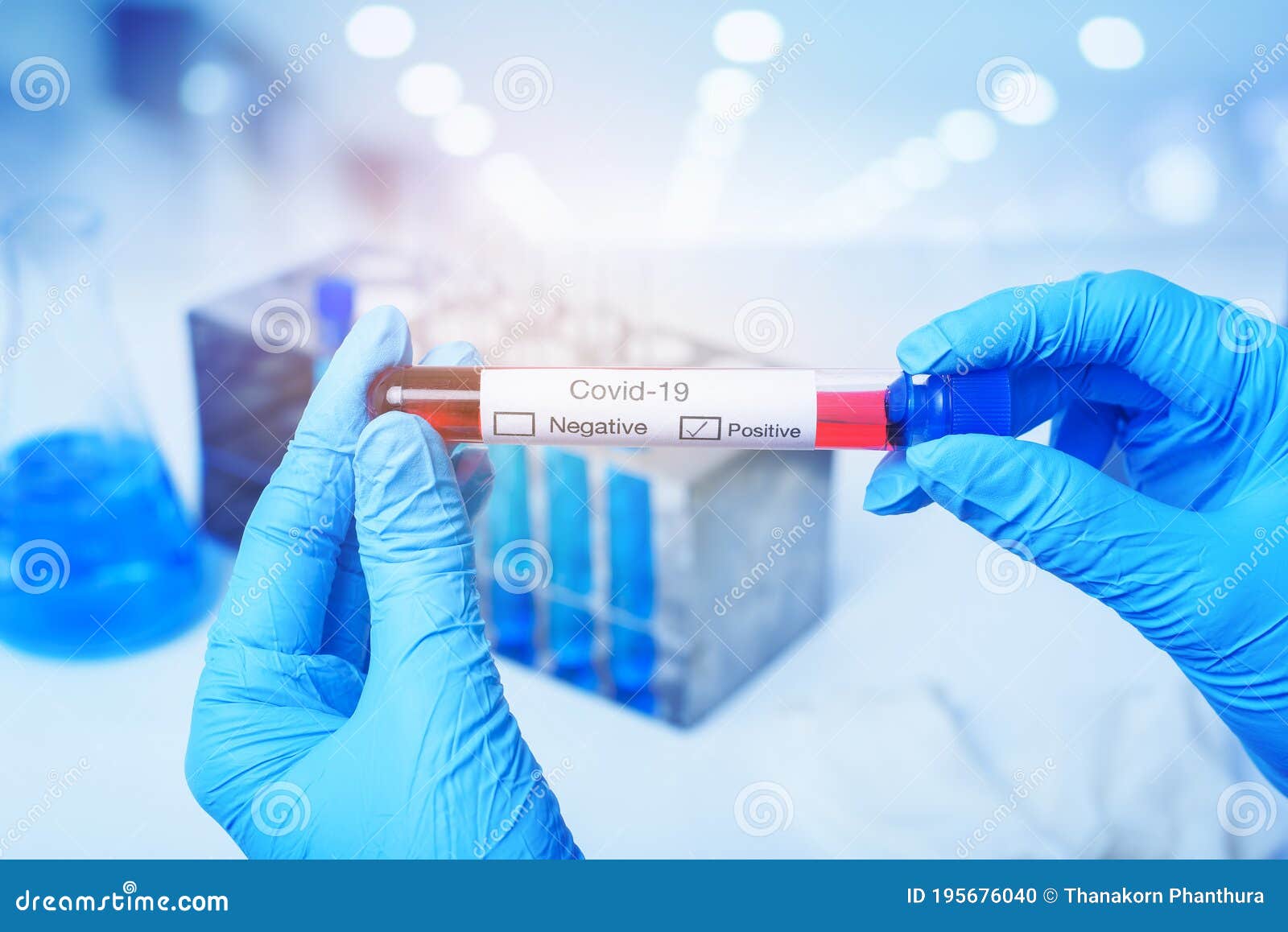 Laboratory Assistant Hand is Holding Blood Test Infected Covid-19 Stock ...