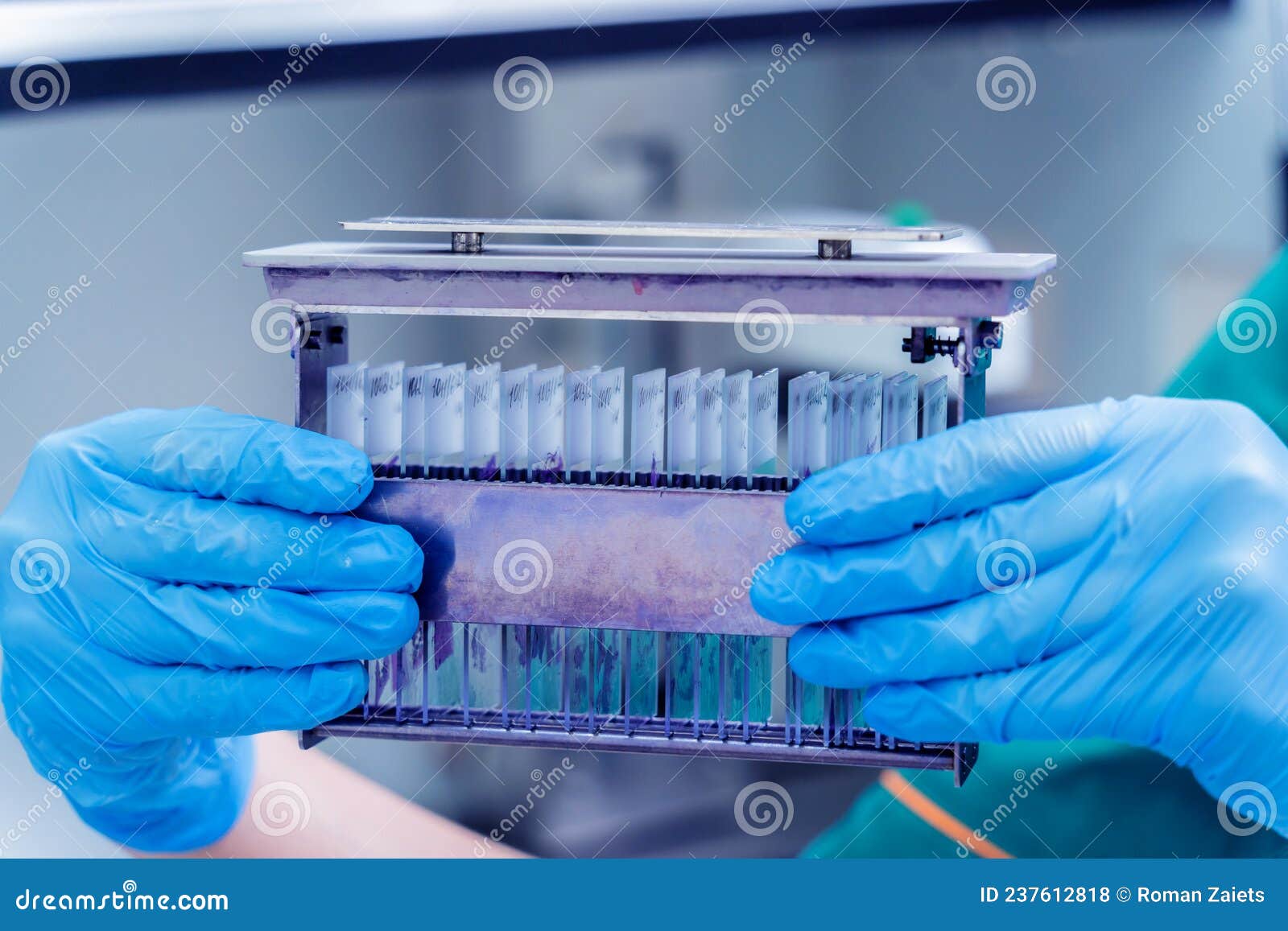 Laboratory Assistant Works with Automatic Multi Slides Stainer at the ...