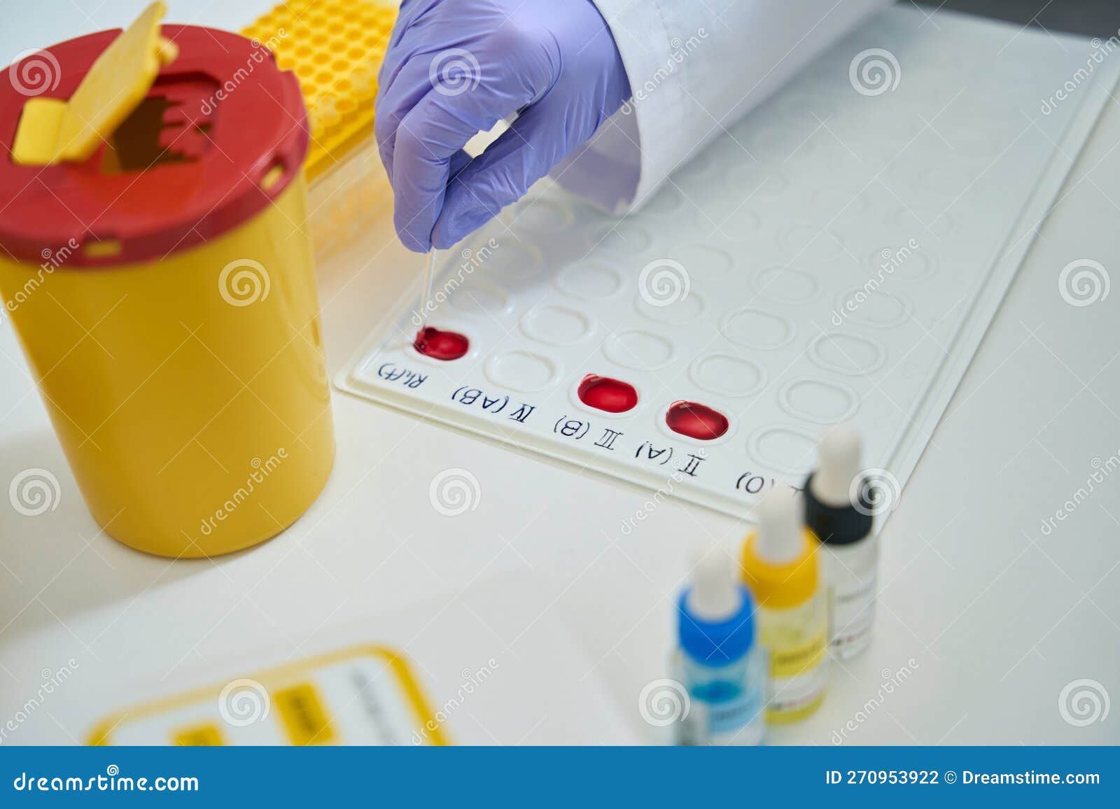 Laboratory Assistant Works with Blood Samples on an Indication Palette ...